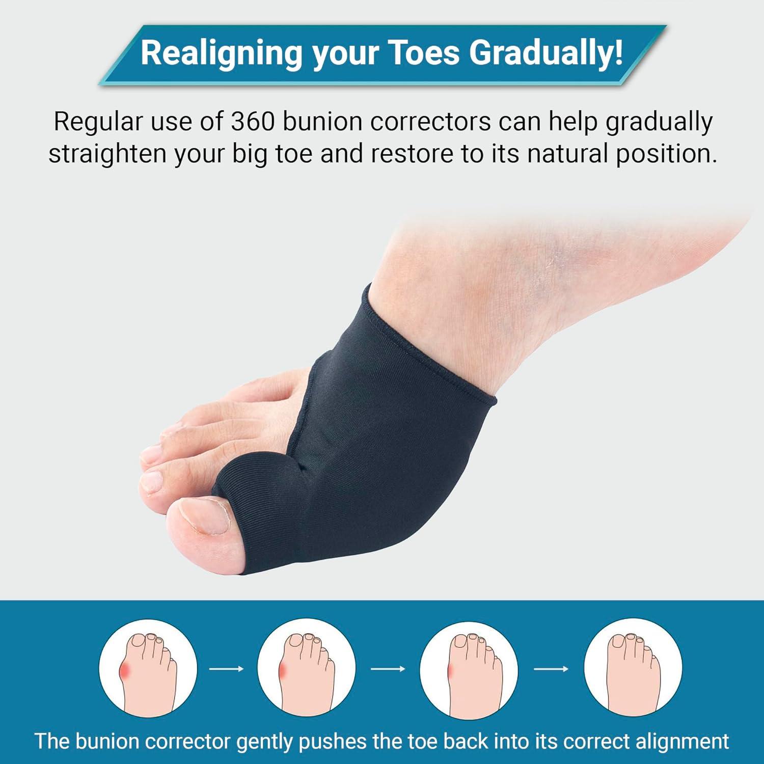 360 RELIEF Silicone Bunion Corrector with Gel Pads - Big Toe Separator ...