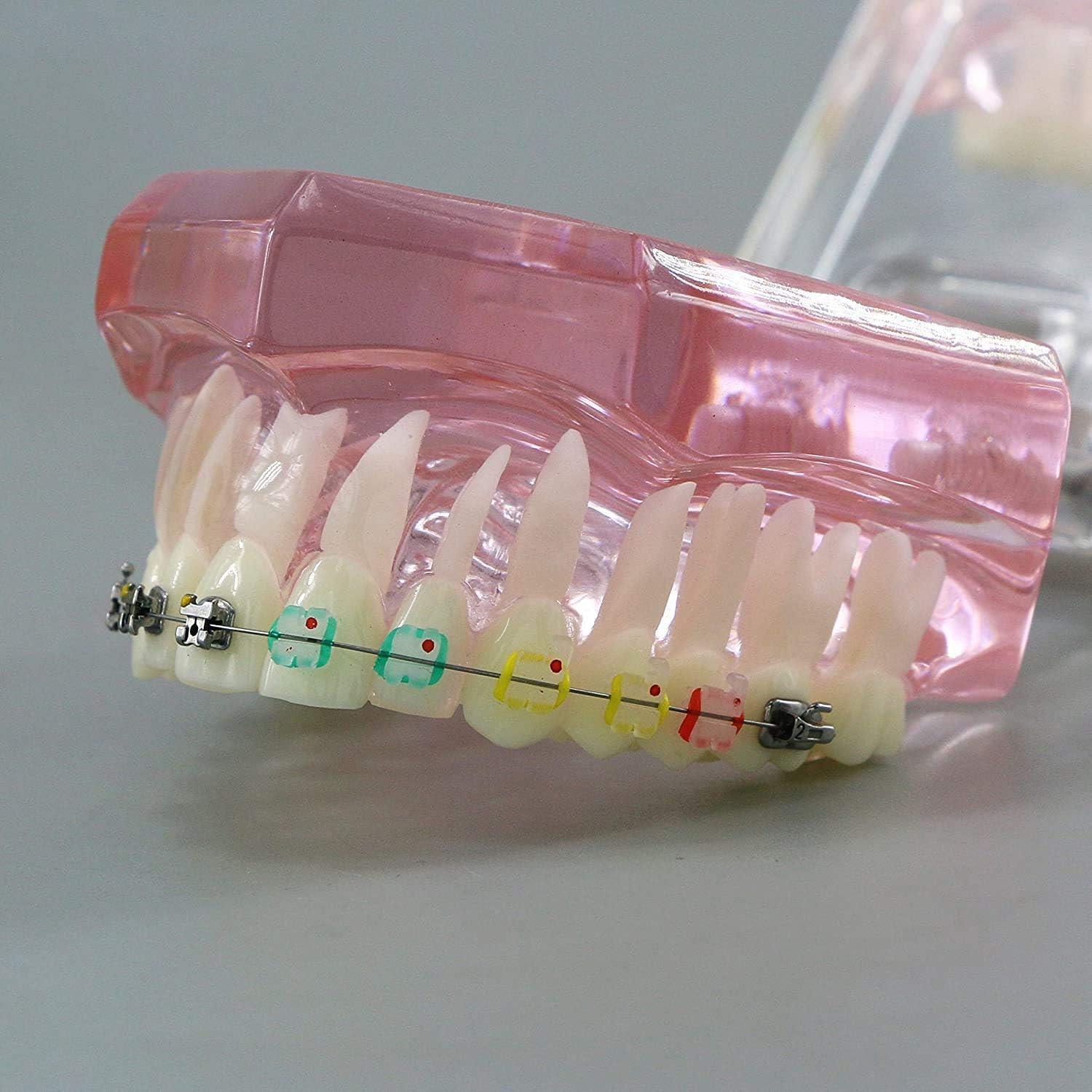 HDGRNCC Dental Orthodontic Brackets Model - Metal Ceramic Self-Ceramic ...