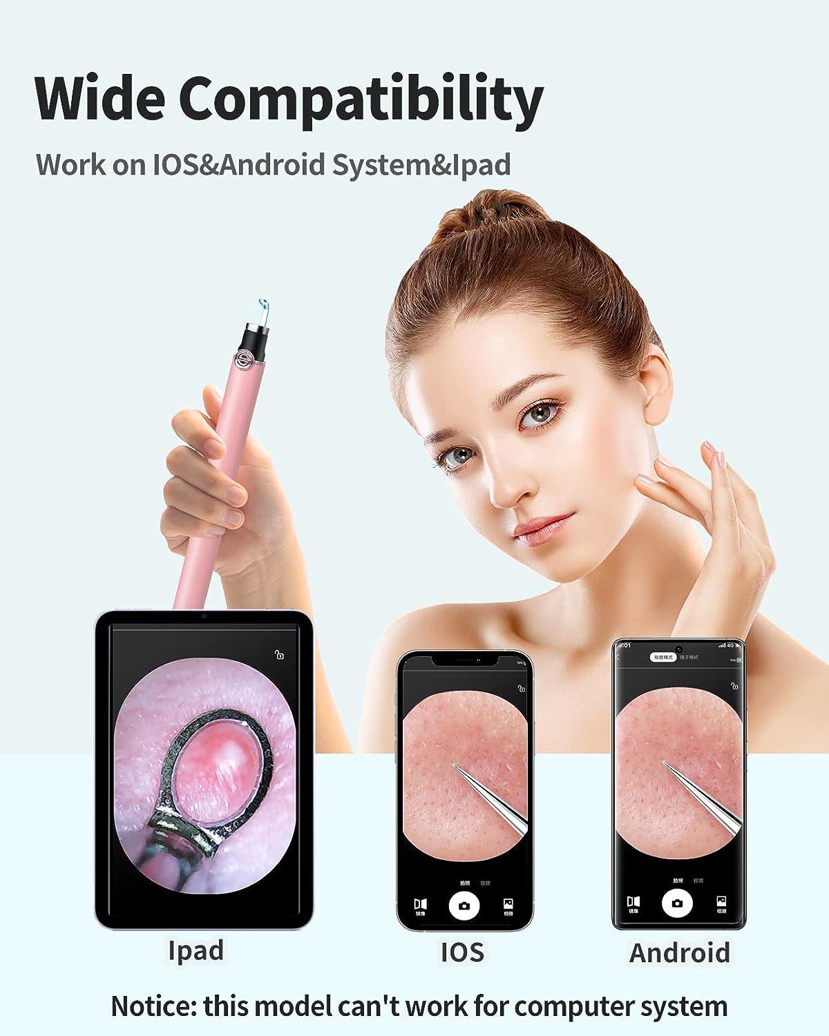 Blackhead Remover Tool Kit with Camera | Stainless Steel Pimple Popper ...