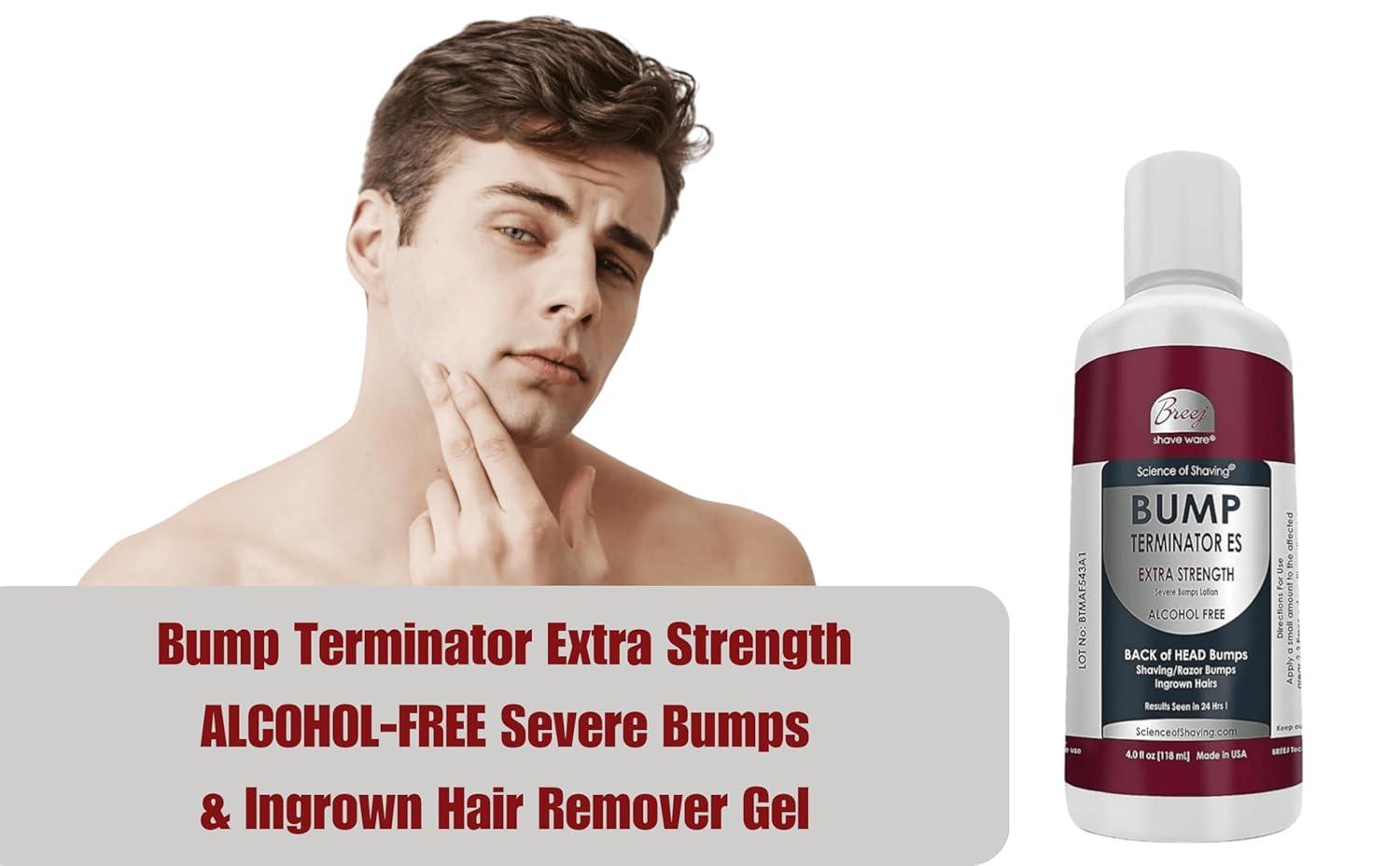 Extra Strength Alcohol-Free Bump Terminator - Anti Bump & Ingrown Hair ...