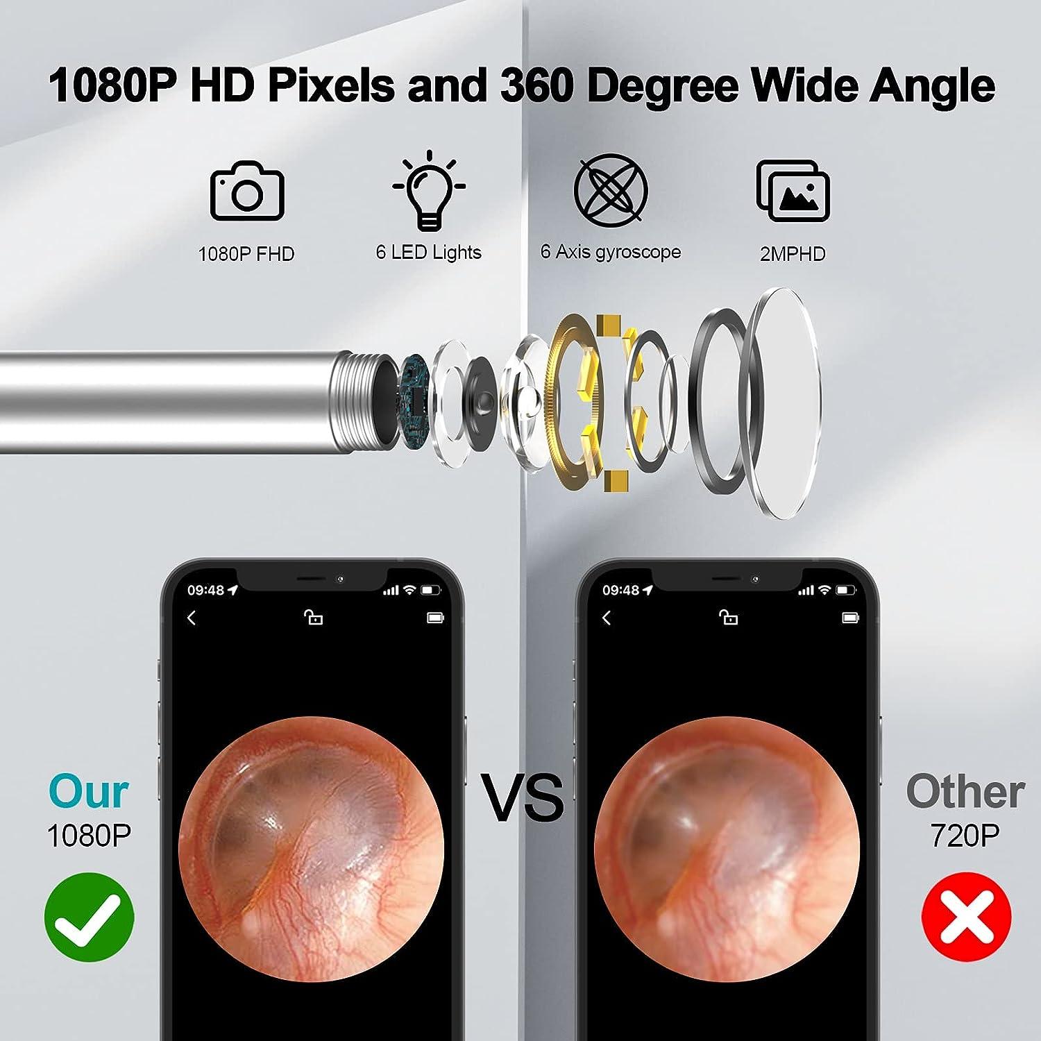 Ear Wax Removal Tool with 1080P Ear Camera and 5 Pcs Ear Set - Grey ...
