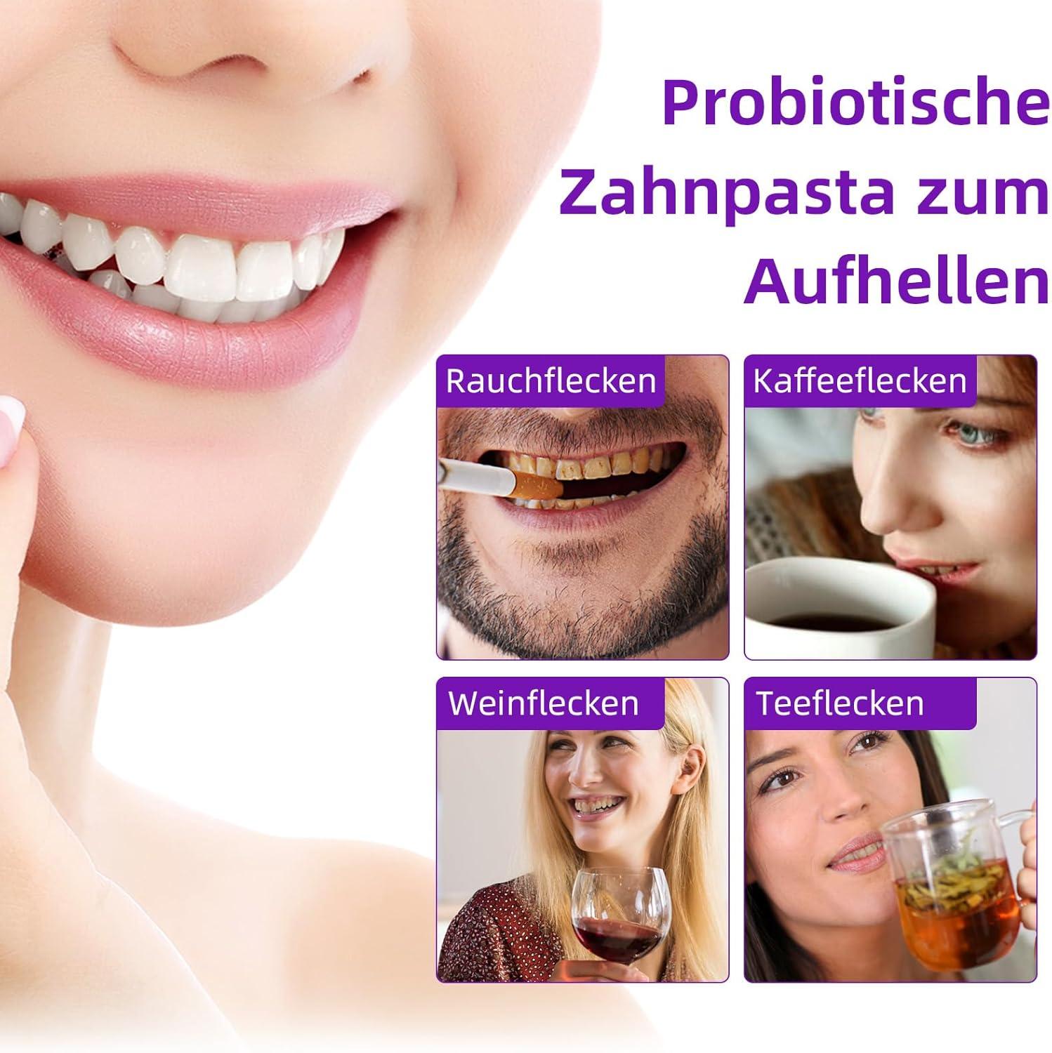 SP-7 Probiotic Toothpaste | Brightening & Stain Removal Fresh Breath ...