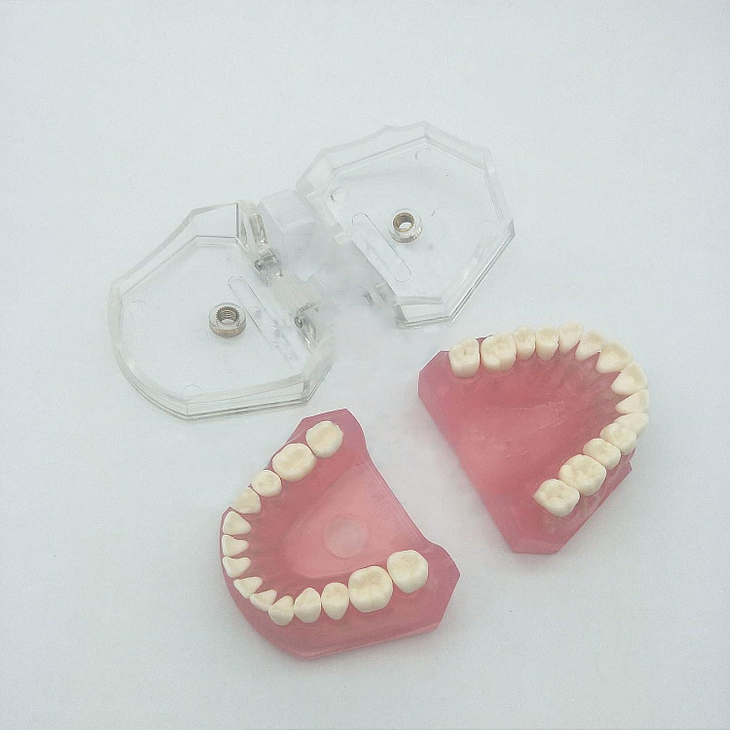 Standard Dental Teeth Model - Removable Full Mouth Resin Crown Model ...