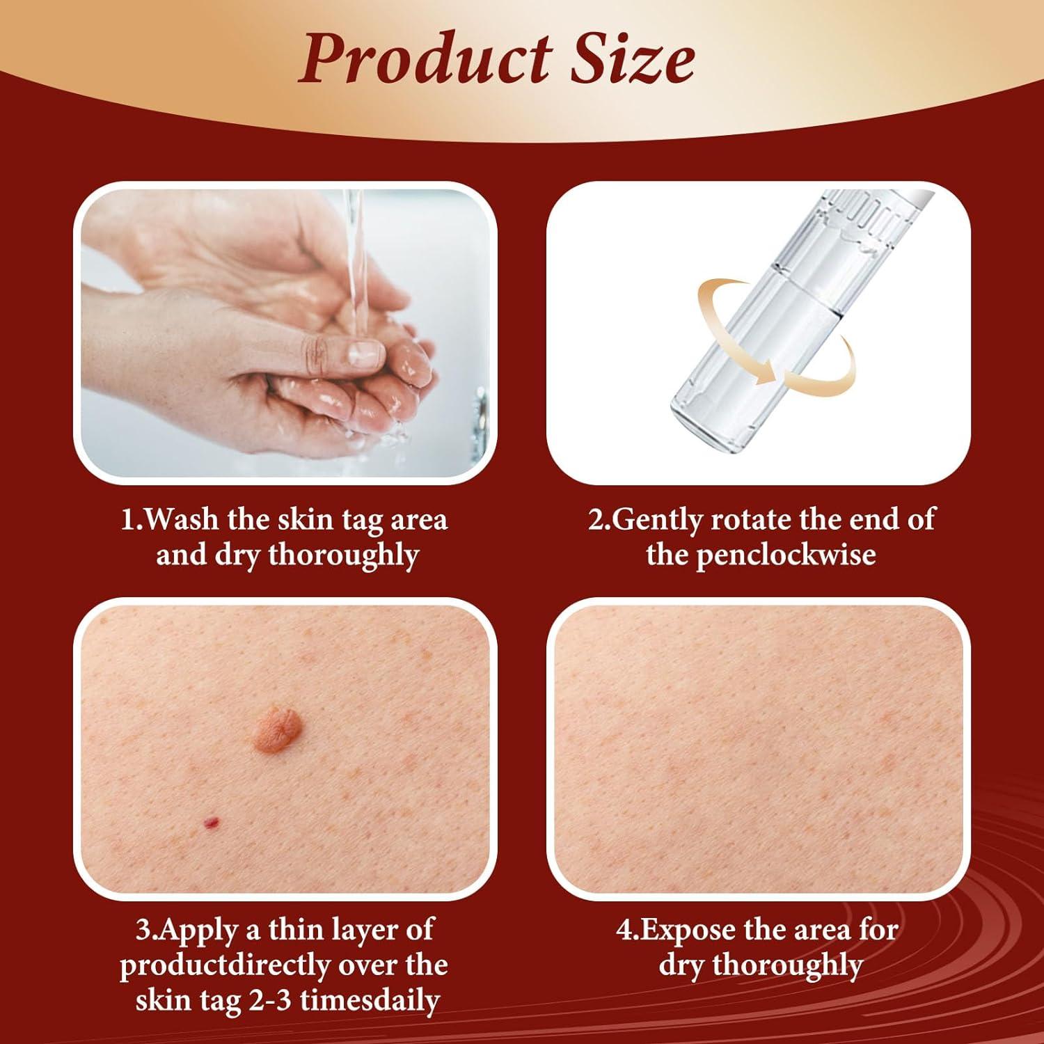 Wipe Off Moles and Skin Tags Remover - Natural Non-Irritating Liquid ...