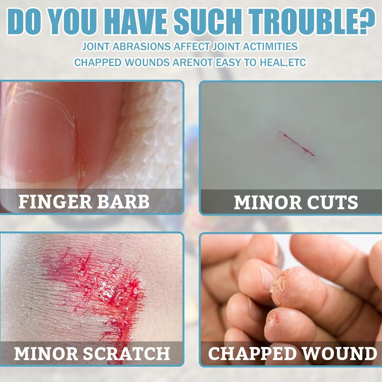 New Skin Liquid Plaster Wound Glue 10ml - Waterproof & Breathable ...