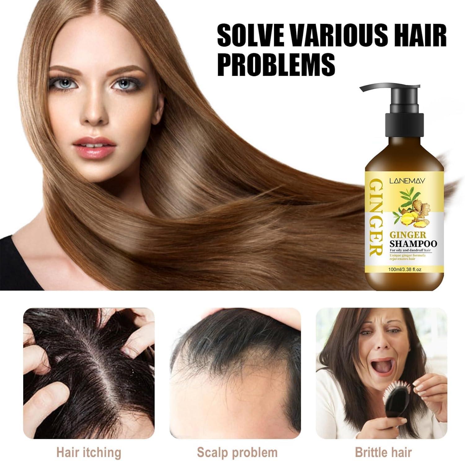 Ginger Hair Shampoo Natural Ginger Anti-Dandruff Shampoo for Hair Loss ...