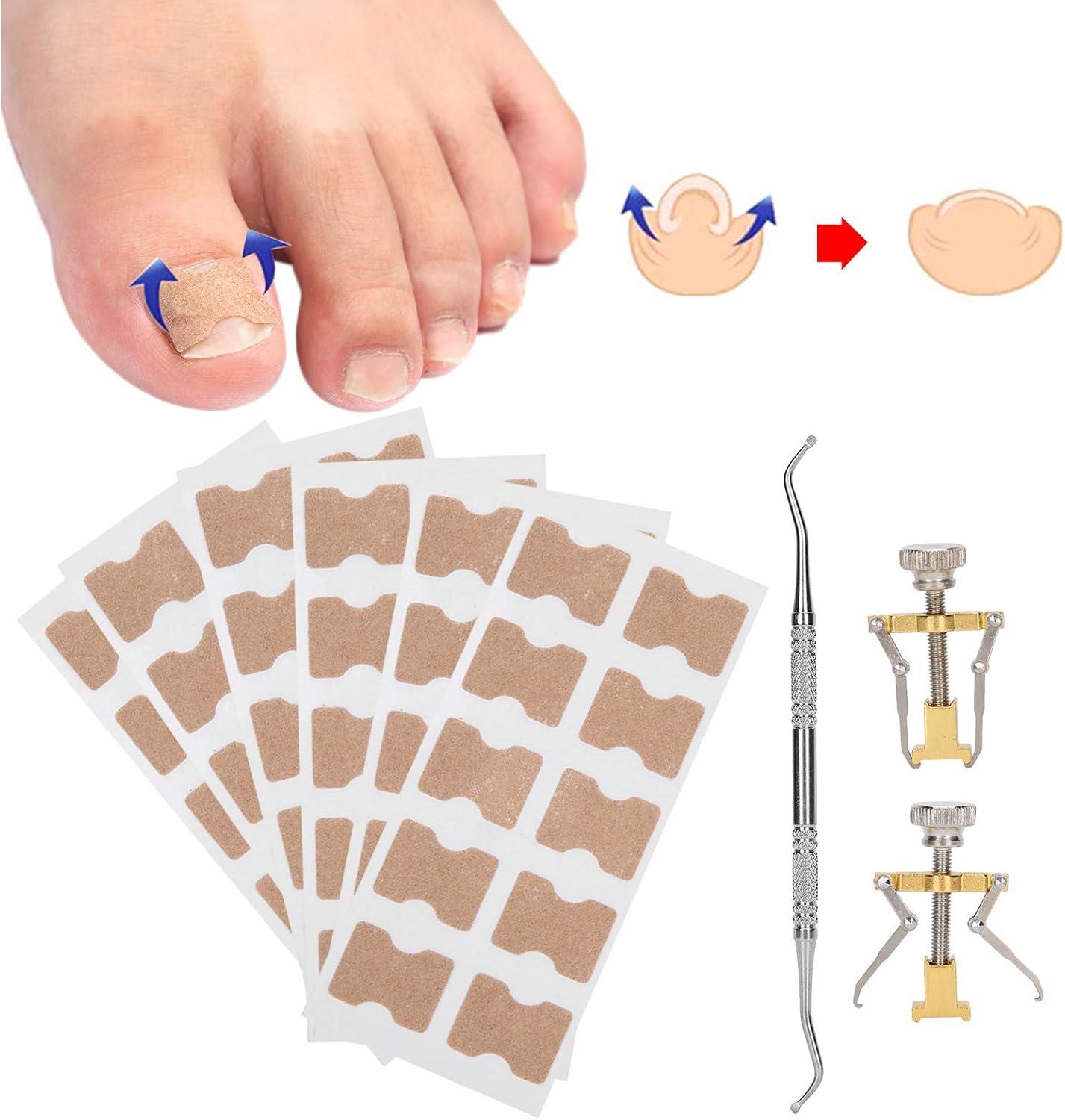 9 Pieces Ingrown Toenail Tools Kit Ingrown Toenail Lifter Ingrown ...