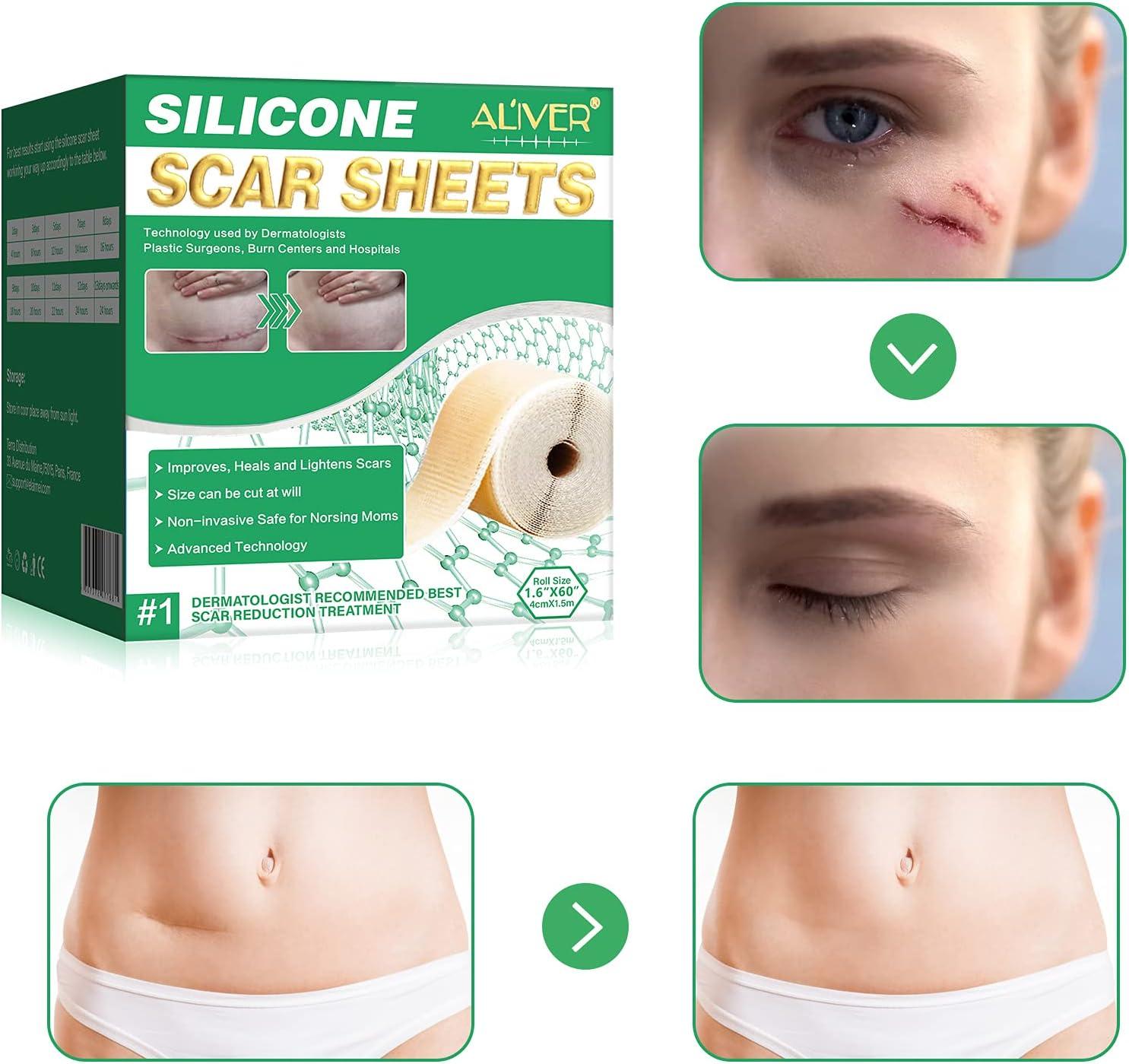 Silicone Scar Sheets Medical Grade Silicone Scar Tape Silicone Scar ...