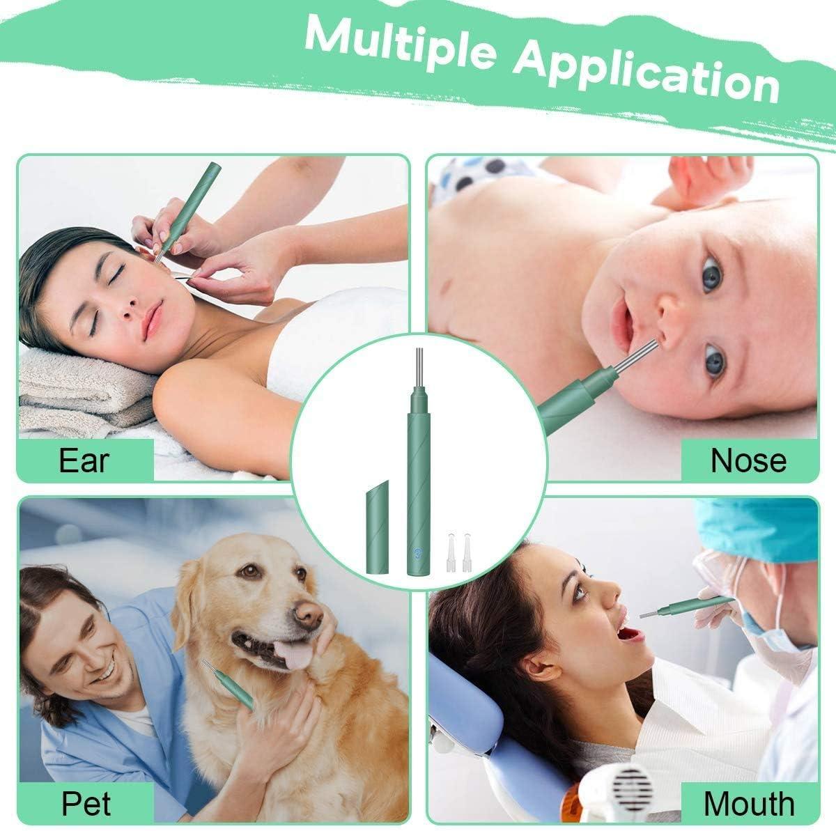 Softula Wireless Otoscope Earwax Removal Tool - 1080P HD WiFi Endoscope ...