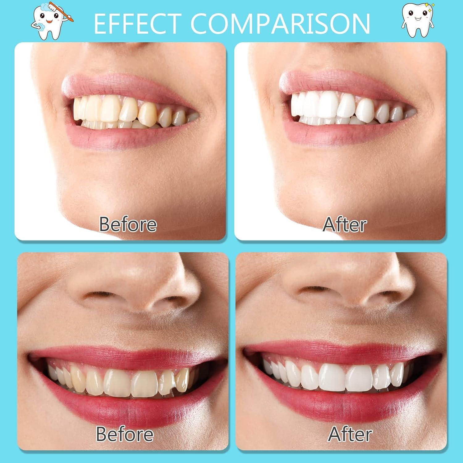 Instant Smile Veneers - 1 Pair False Teeth Top and Bottom Set for Men ...