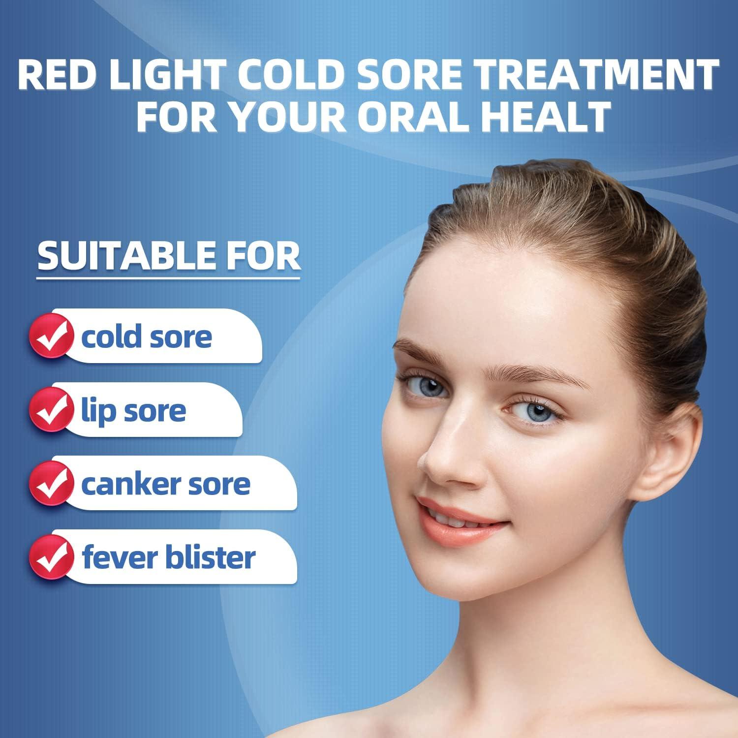 Buy Red Light Therapy Device for Cold Sores & Fever Blisters | Fast ...