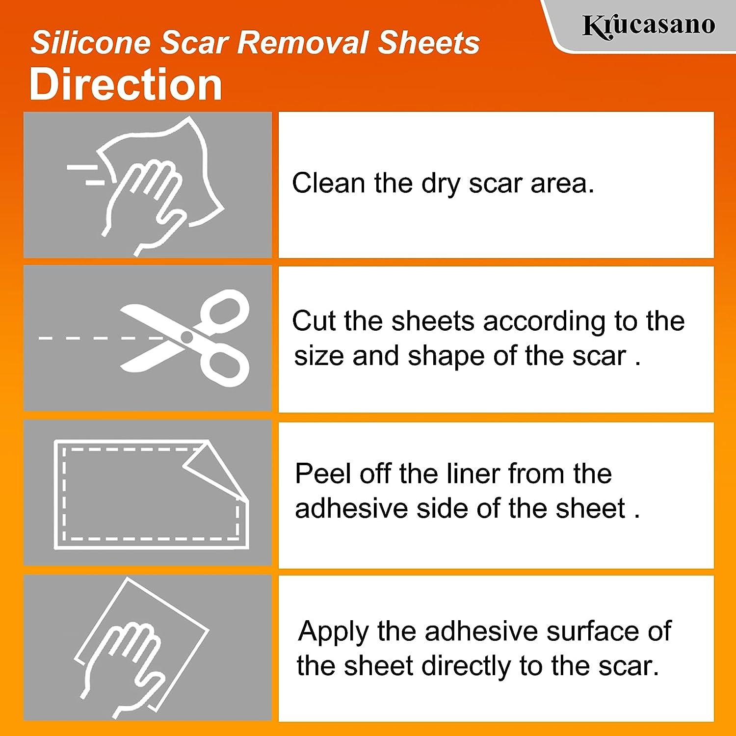 Professional Silicone Scar Sheets Silicone Scar Removal Sheets for ...