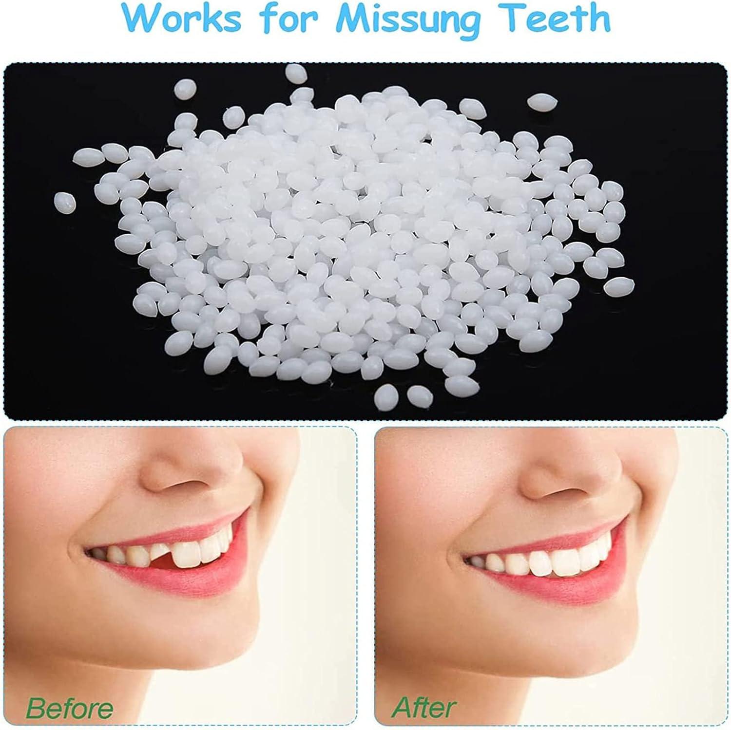 Buy Giural Veneer Teeth - Instant Snap-In Dental Veneers for Men ...