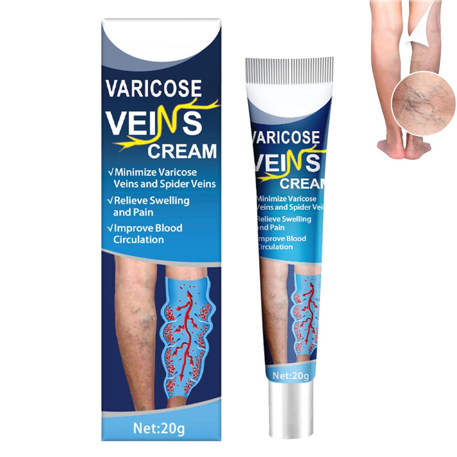 Varicose Vein Cream 20g - Pain Relief & Spider Veins Repair | Buy Now ...
