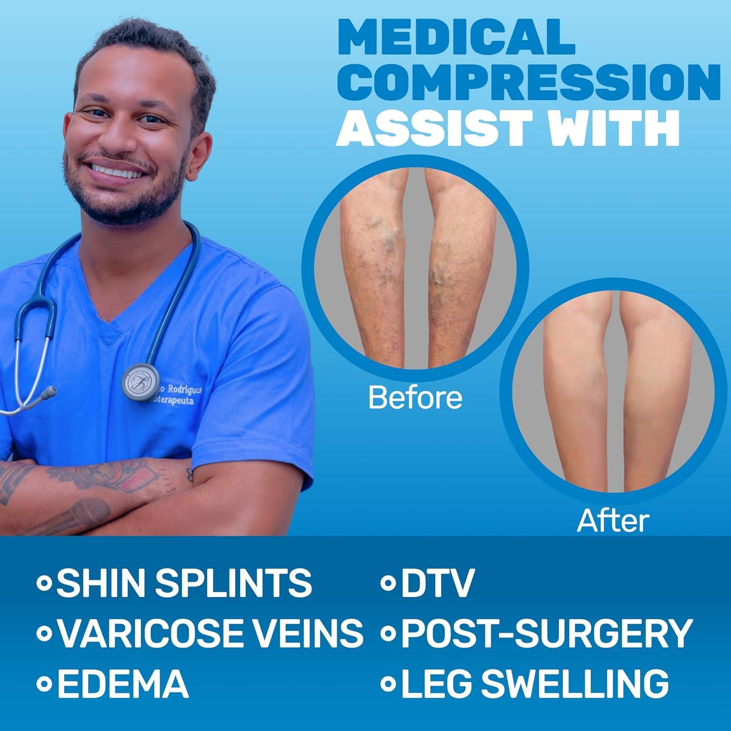 Buy Absolute Support Compression Tights for Women | Class 2 (20-30 mmHg ...