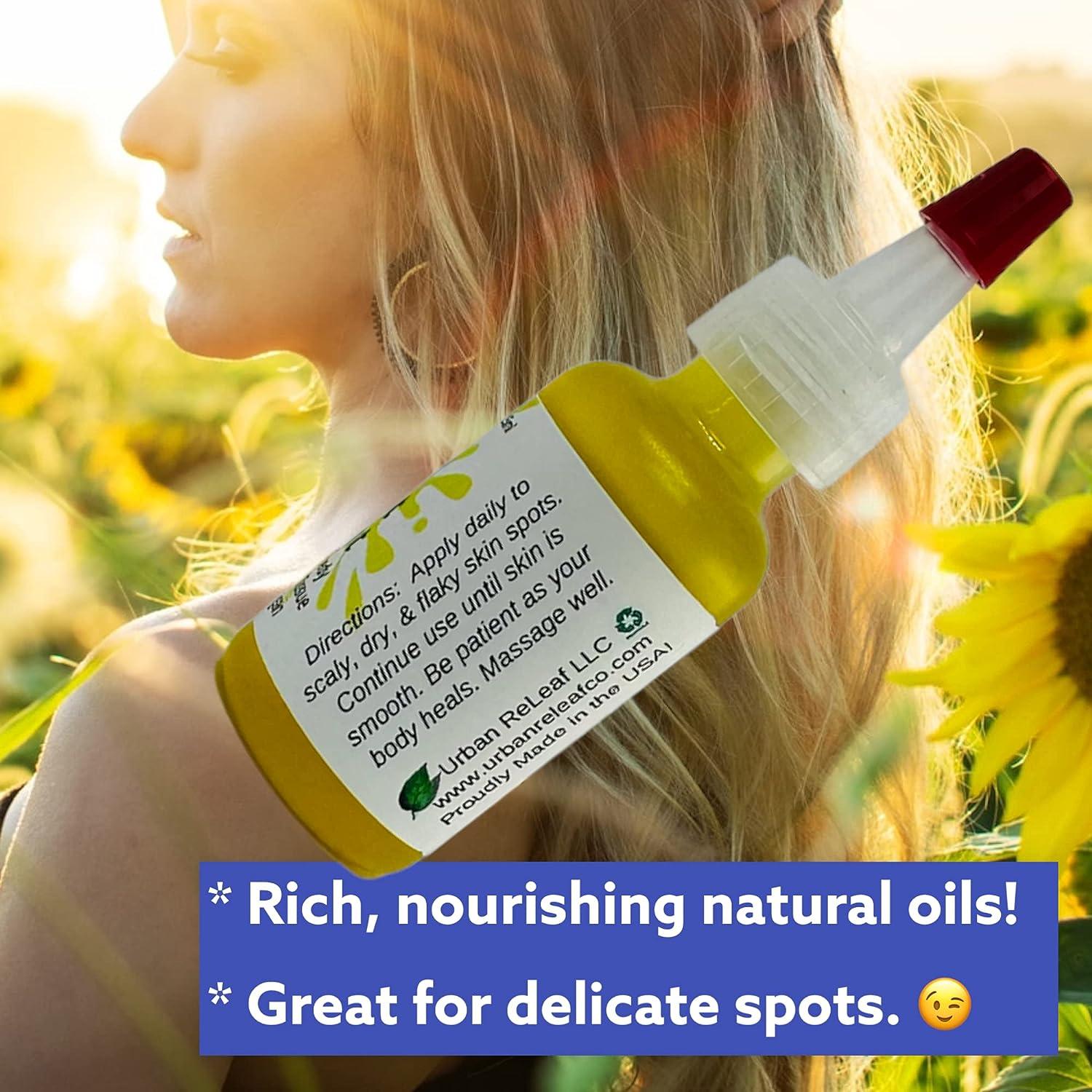 Urban ReLeaf Scaly Skin Spot Treatment - Natural Repair Oil for Flaky ...
