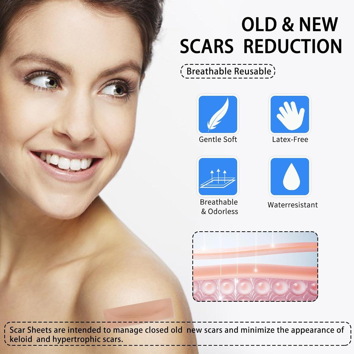 Silicone Scar Sheets - Reusable Scar Removal Strips for Surgical Scars ...