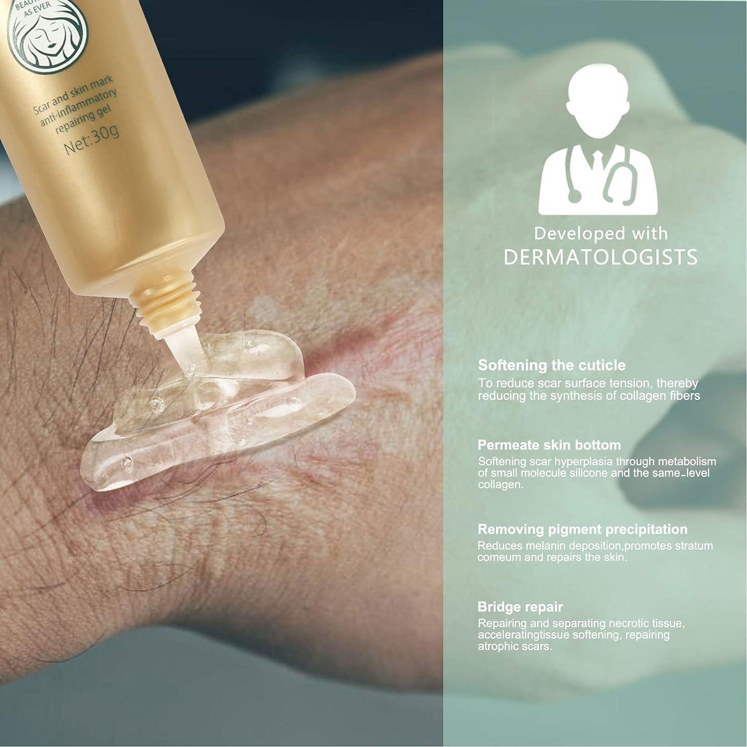 Scar Removal Cream - 30g - Fade Scars, Stretch Marks & Burns ...