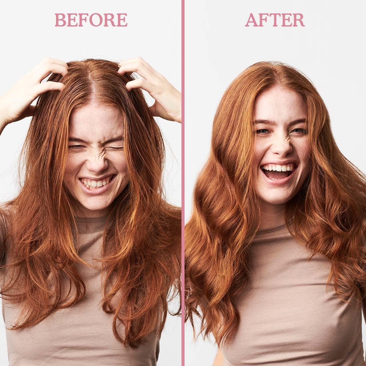 Umberto Giannini Scalp Rescue Scrub - 250g | Vegan & Cruelty-Free Anti ...