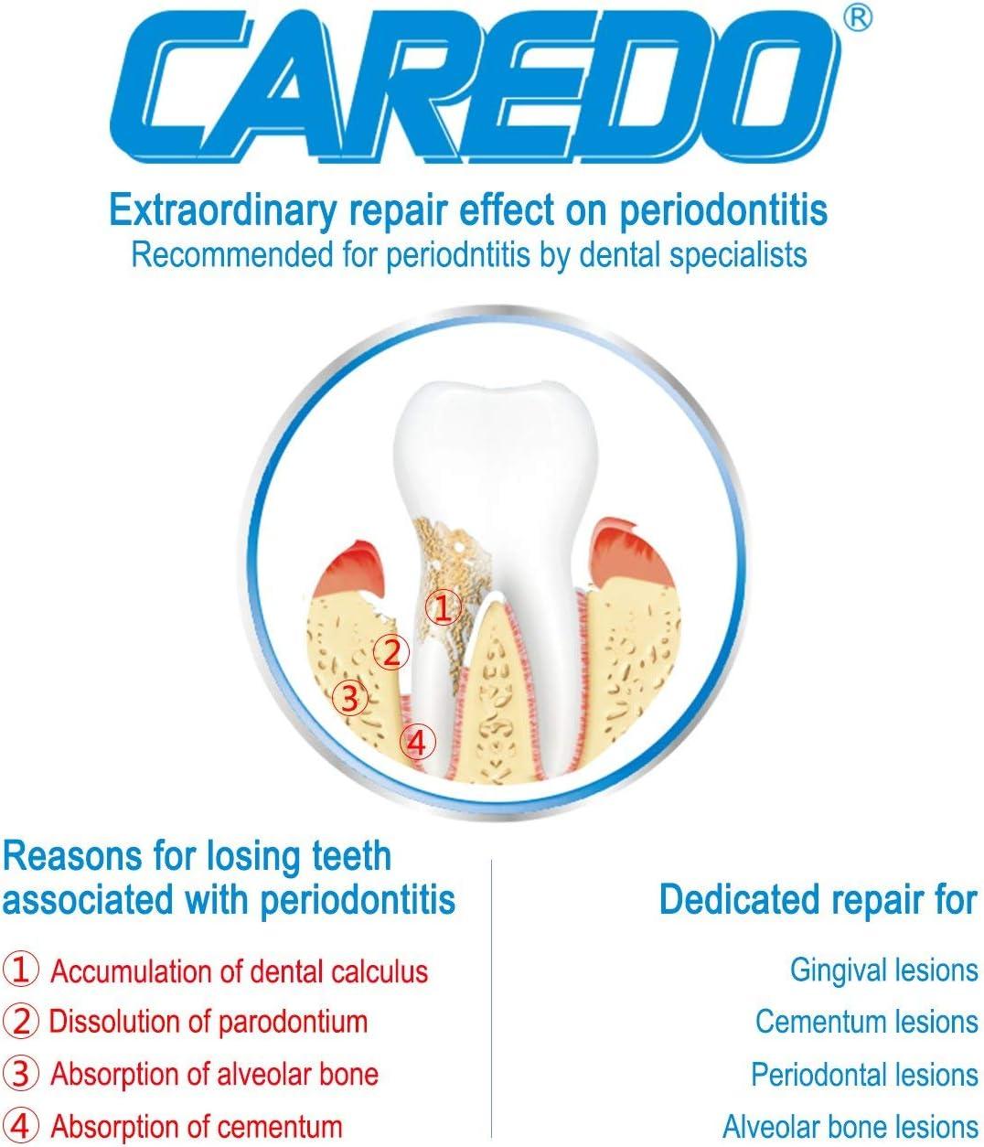 CAREDO Healing Periodontitis Treatment Toothpaste - Gingivitis & Gum ...