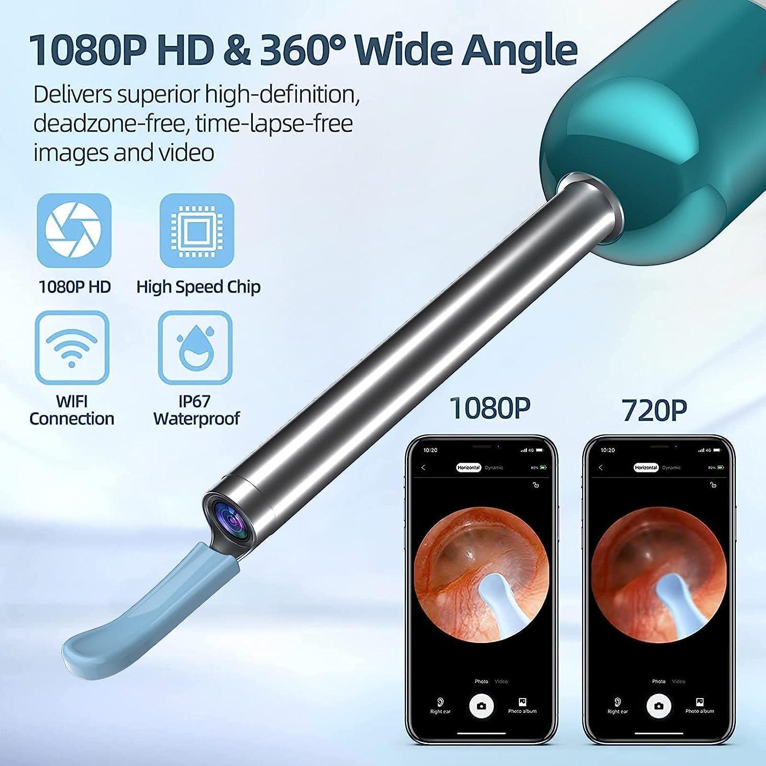 1080p Full HD Ear Wax Removal Otoscope with 9 Pcs Ear Set - Ear Camera ...