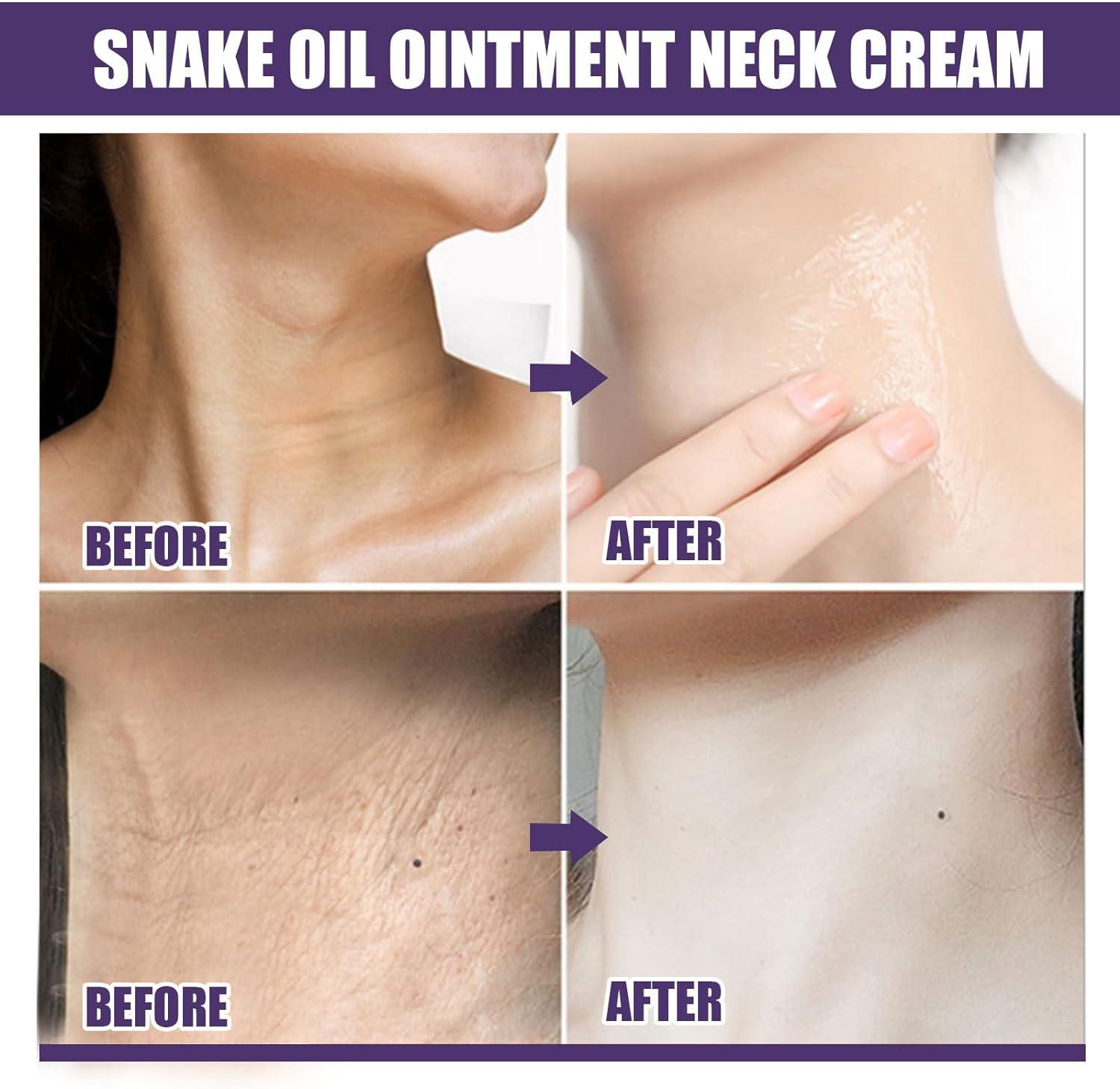 Neck Firming Cream for Tightening & Wrinkles | Anti-Aging & Lifting ...