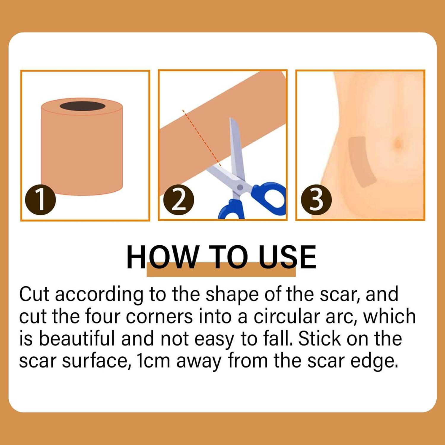 Soft Silicone Scar Tape Roll - Reusable & Waterproof Invisible ...