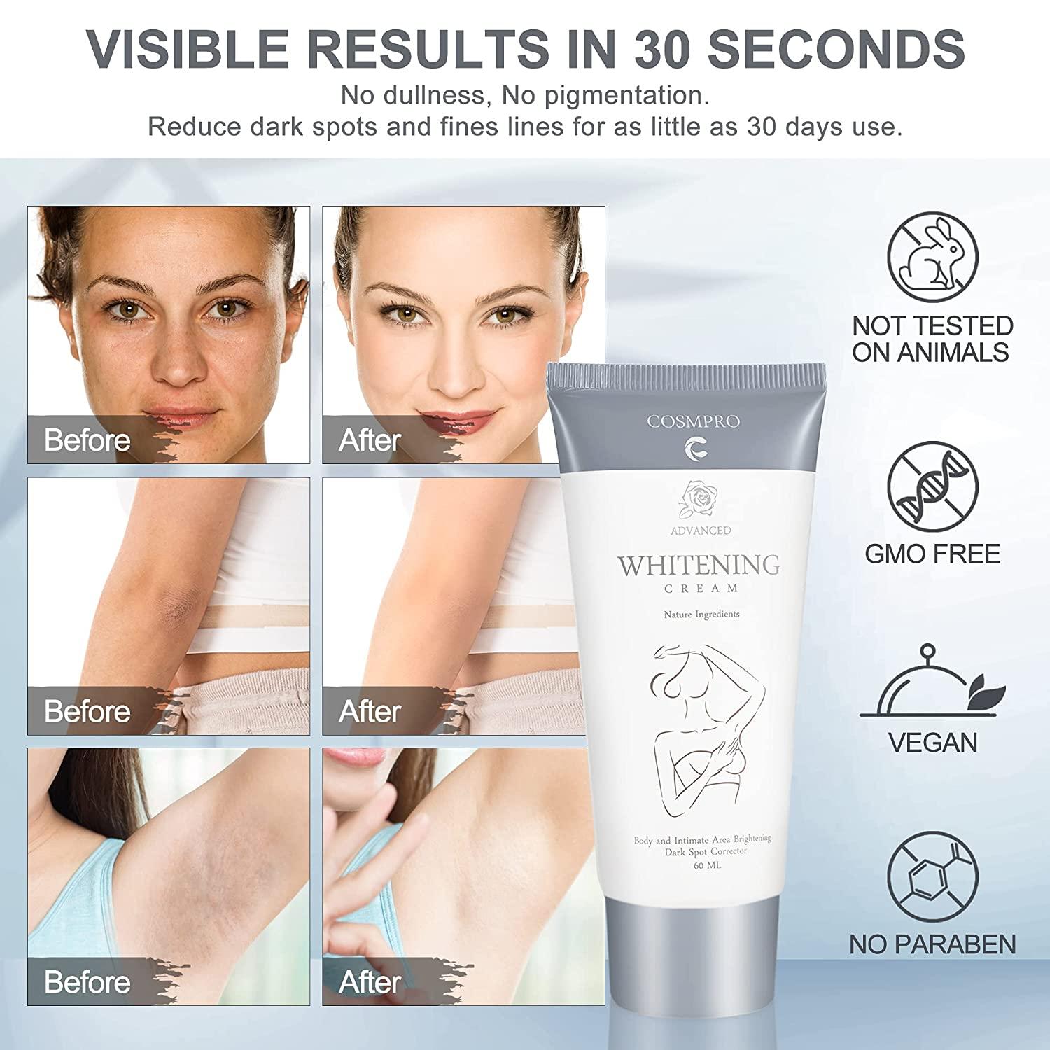COSMPRO Skin Bleaching Cream - Intimate Area & Body Brightening ...