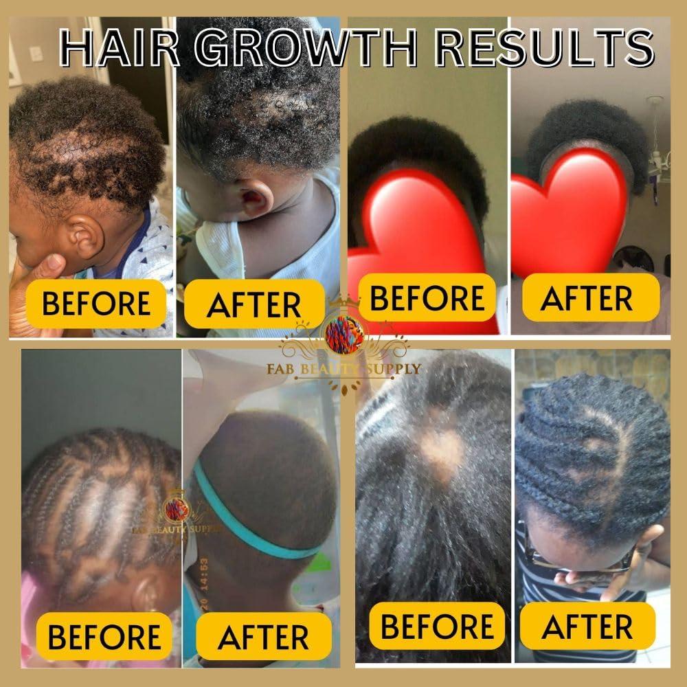 Extra Strength Hair Growth Oil | Essential Oils for Thinning Hair & Dry ...