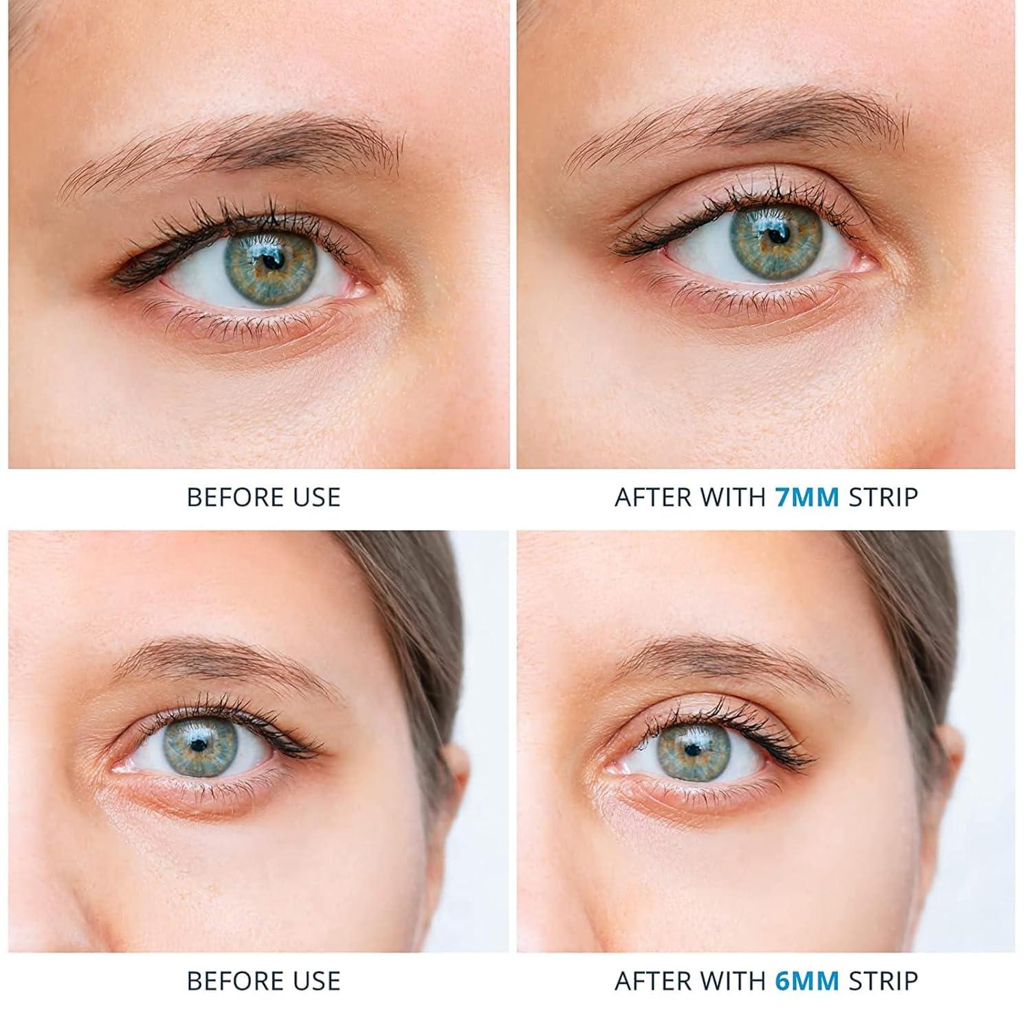 KIREIDA 100 LOUTOR Slidy Stripes - Invisible Eyelid Lifting Tapes for ...