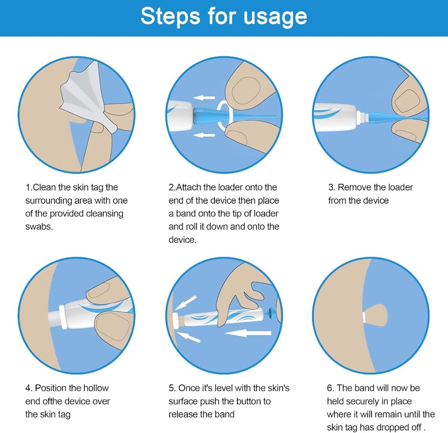 Skin Tag Remover Skin Tag Removal Kit Tools with 40 Micro and Regular ...