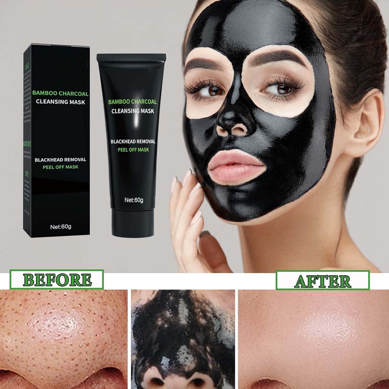 blackhead extraction mask