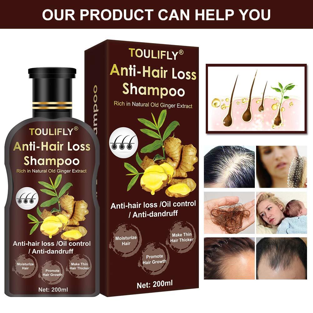 Ginger Hair Regrowth Shampoo for Men and Women | Hair Loss Treatment ...