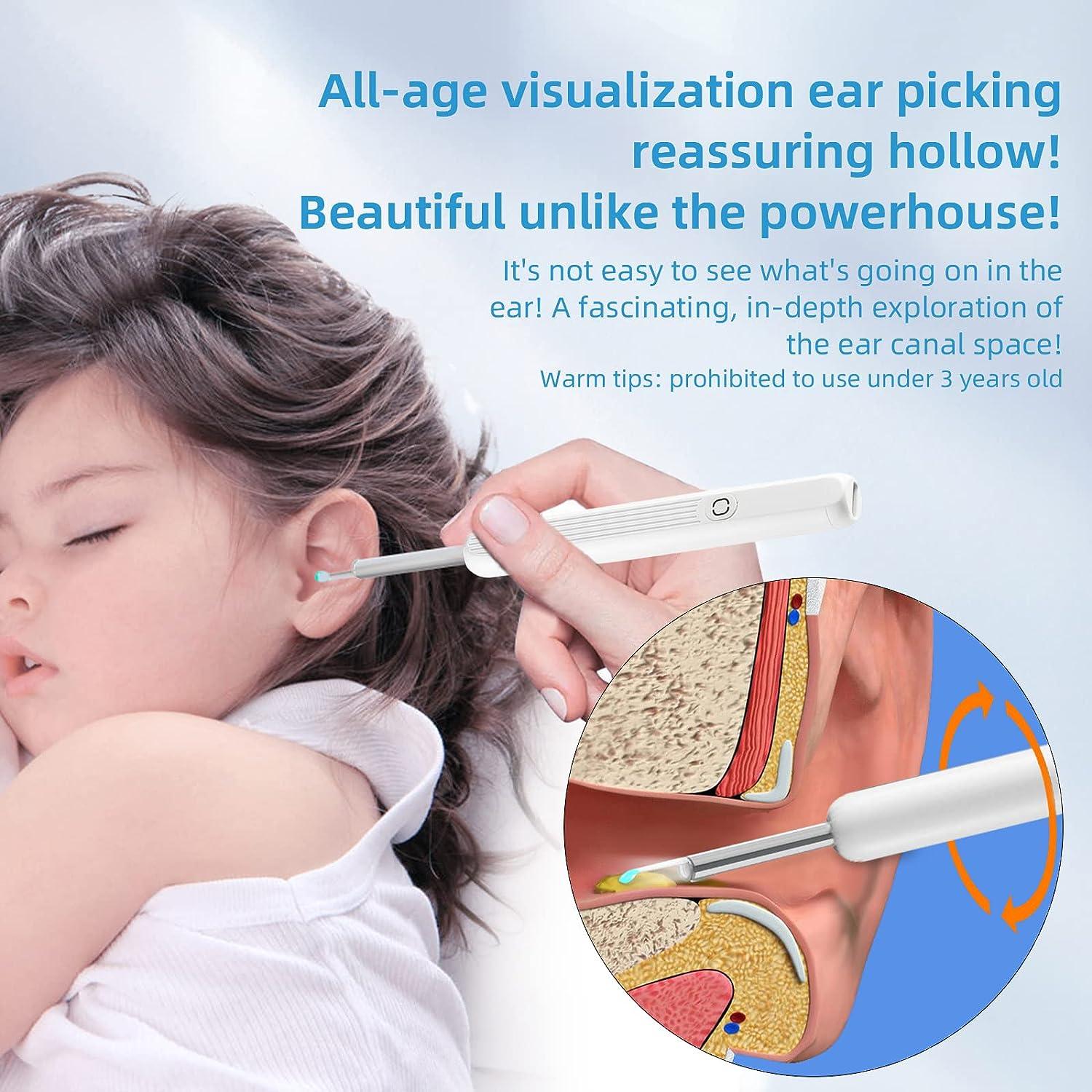 AVM Ear Wax Removal Wireless Endoscope Camera with Earwax Cleaner Kit ...