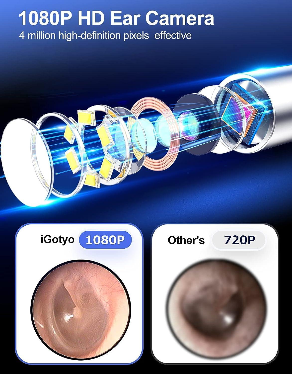 1080P FHD Ear Wax Removal Tool Camera with 6 LED Lights - Waterproof ...