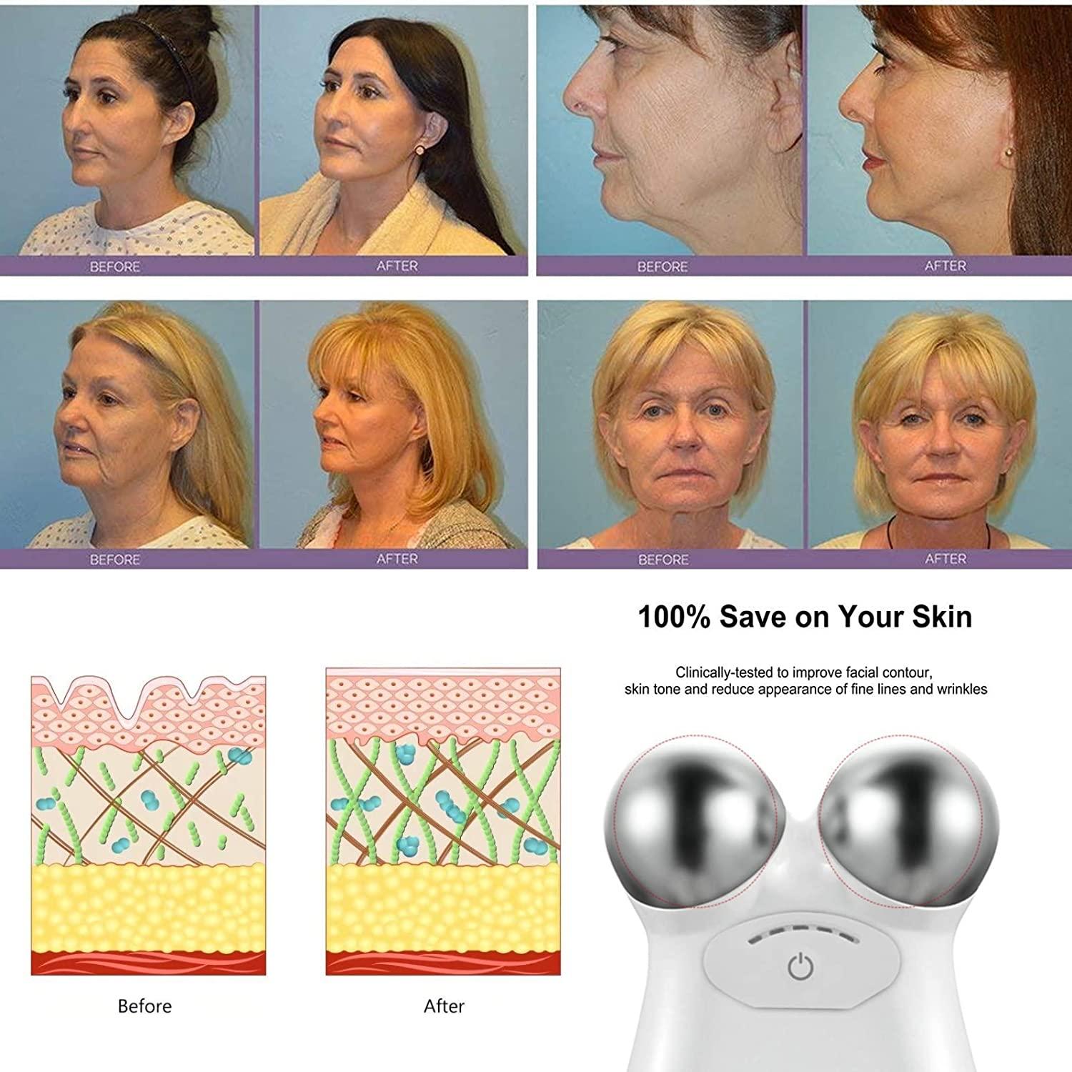 2023 New Microcurrent Face Roller - Lift and Tighten Skin | USB Mini ...