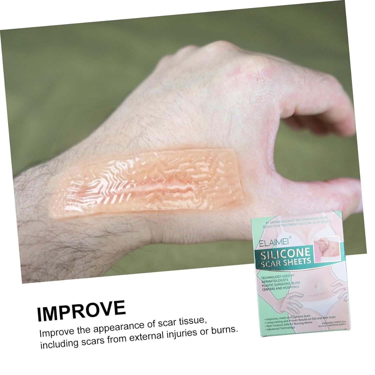 Silicone Scar Sticker 4pcs for Wound Repair & Care - Silicone Strips ...
