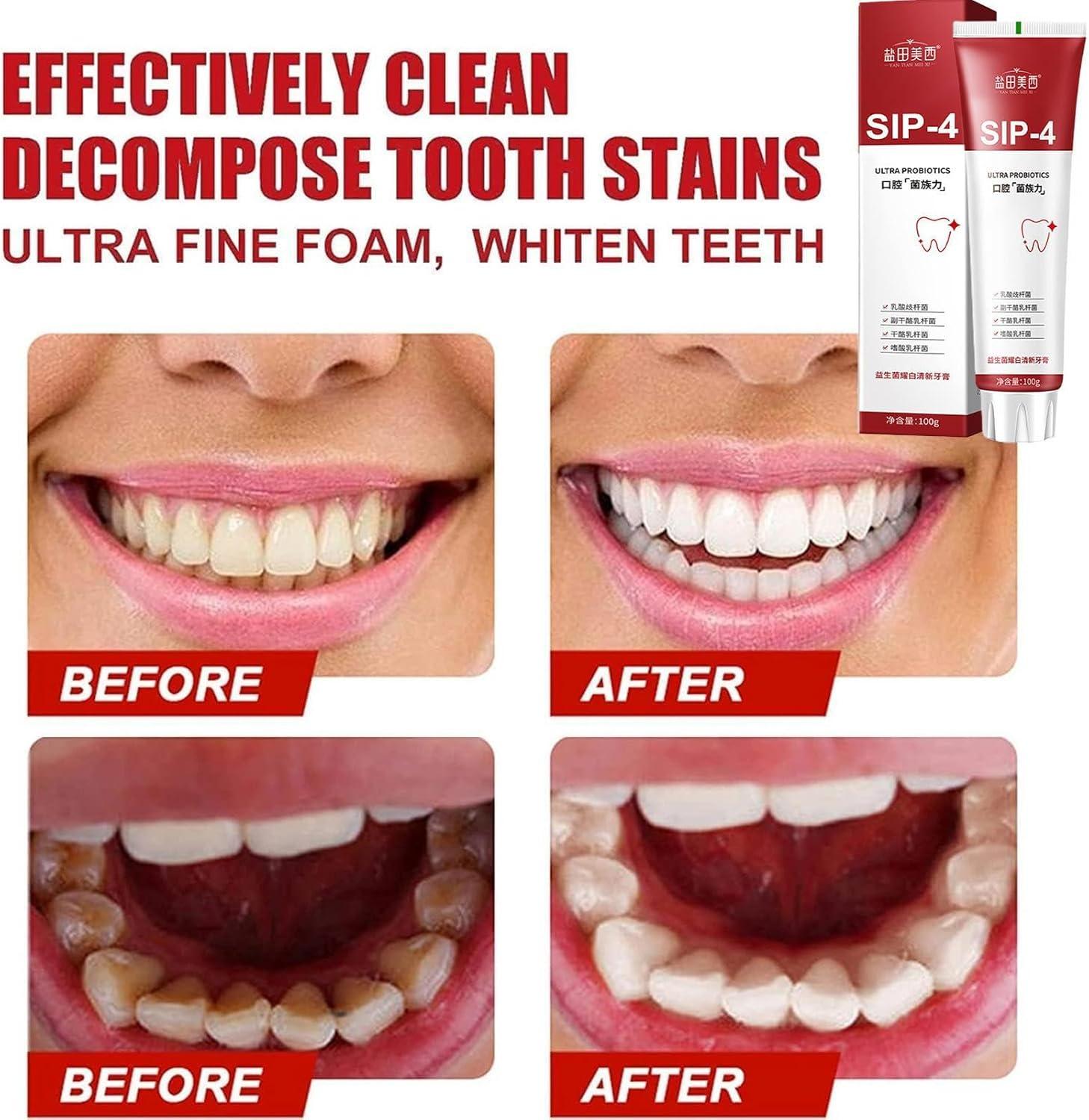 SIP-4 Probiotic Toothpaste - Stain Removal & Fresh Breath ...
