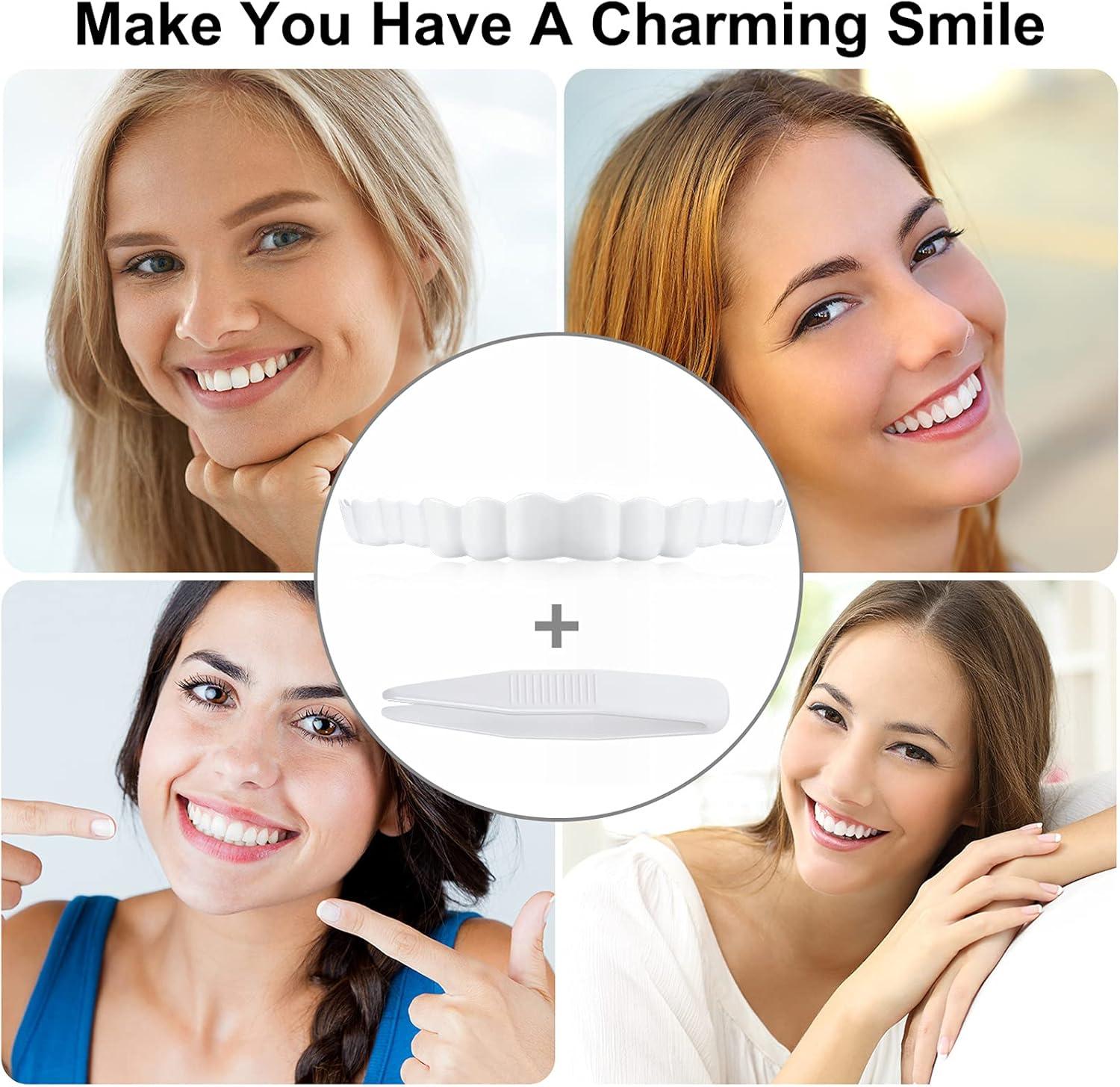 Immediate Veneers Prostheses - Fake Teeth for a Perfect Smile | Jagged ...
