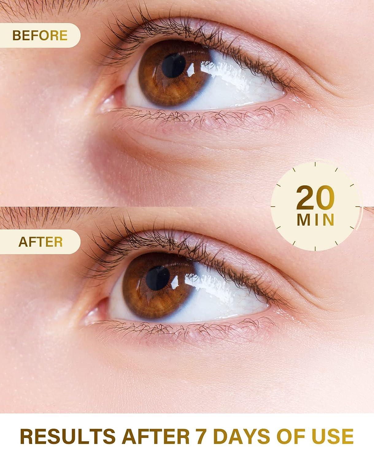 Dr. Pure Under Eye Patches (50 Pairs) - Puffy Eyes & Dark Circles ...