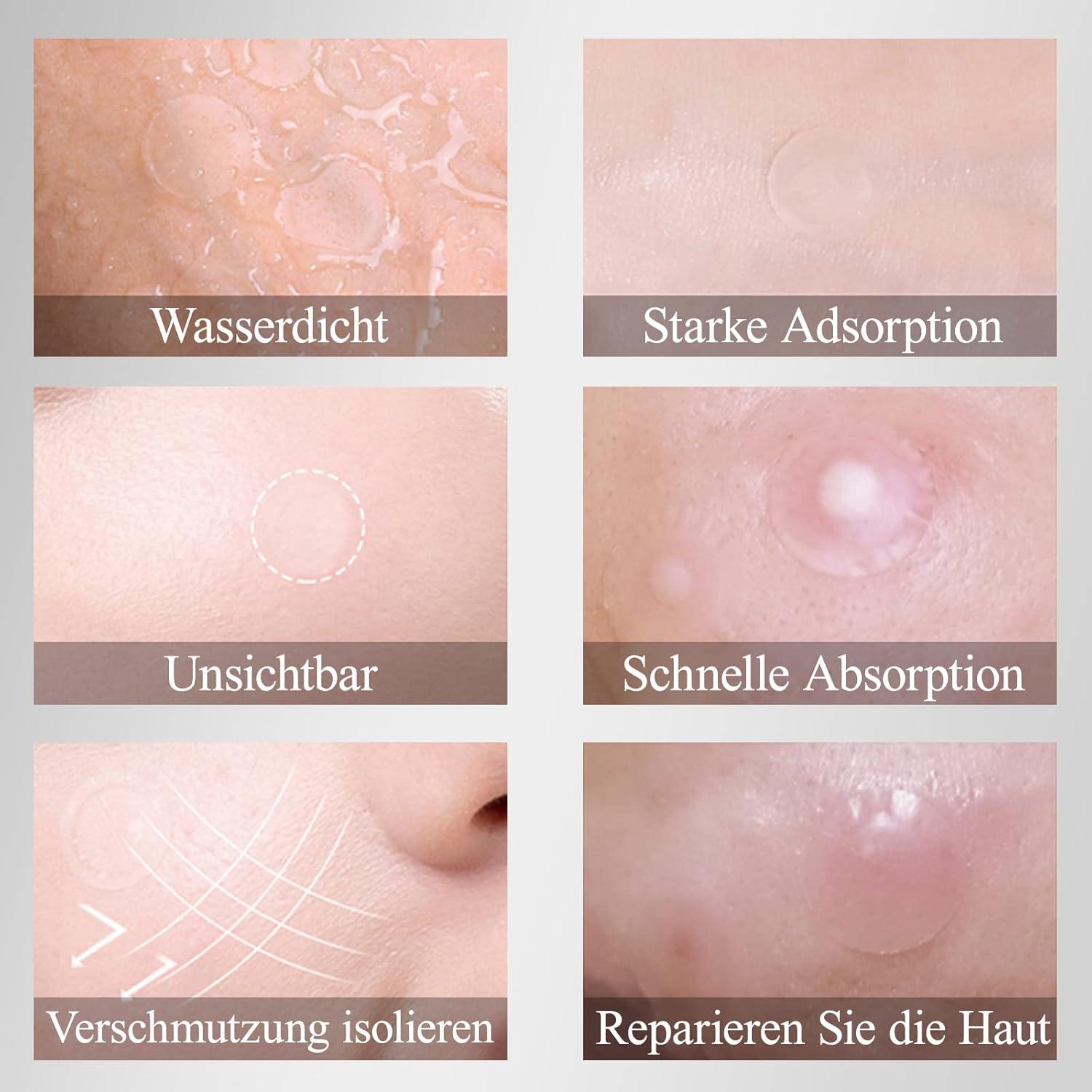252 Acne Pimple Patch - 2-in-1 Day & Night Solution for Fast Acne ...