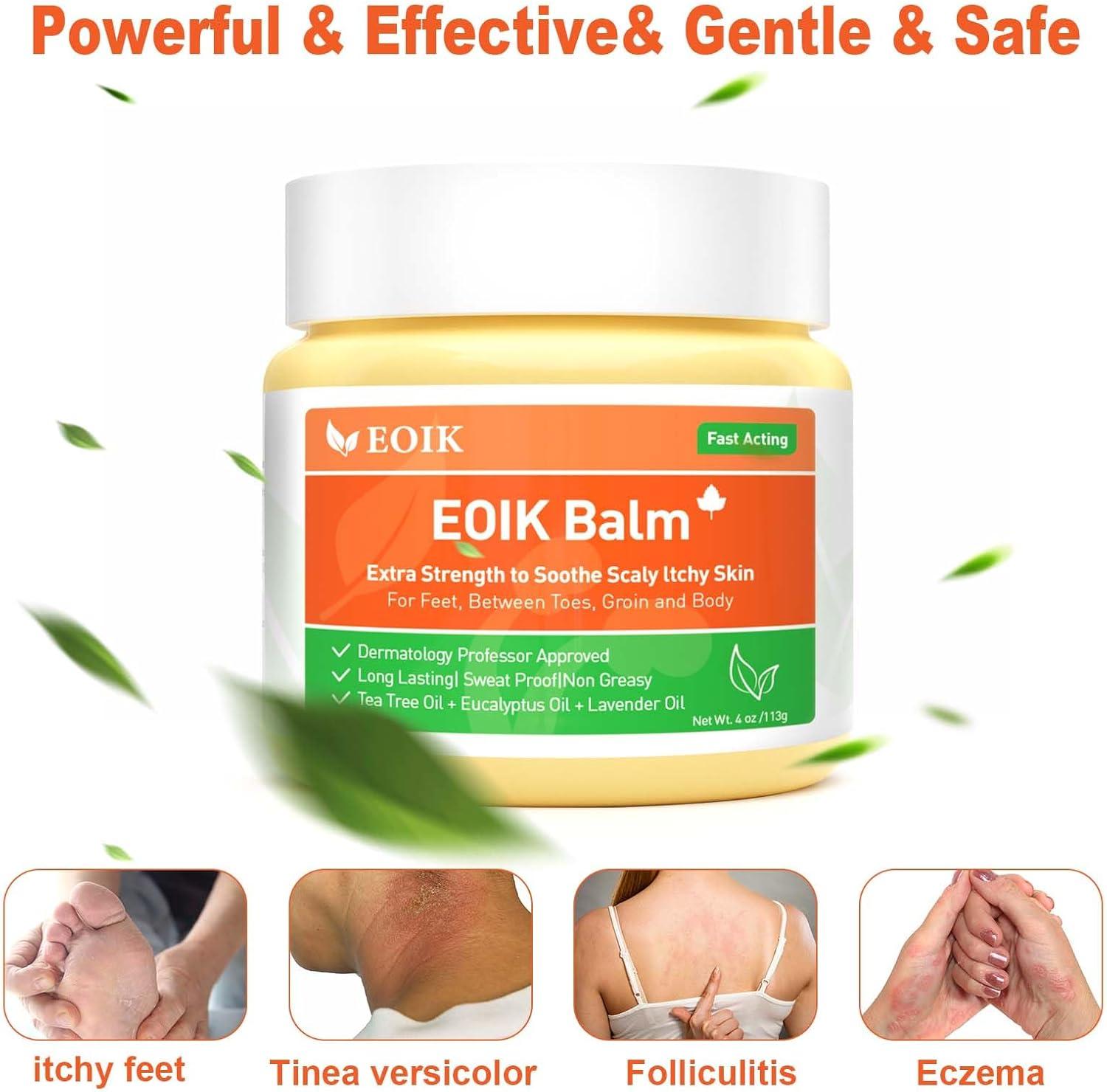 Heat Rash Cream Eczema Hand Foot Treat Tinea Versicolor Itchy Feet Butt ...