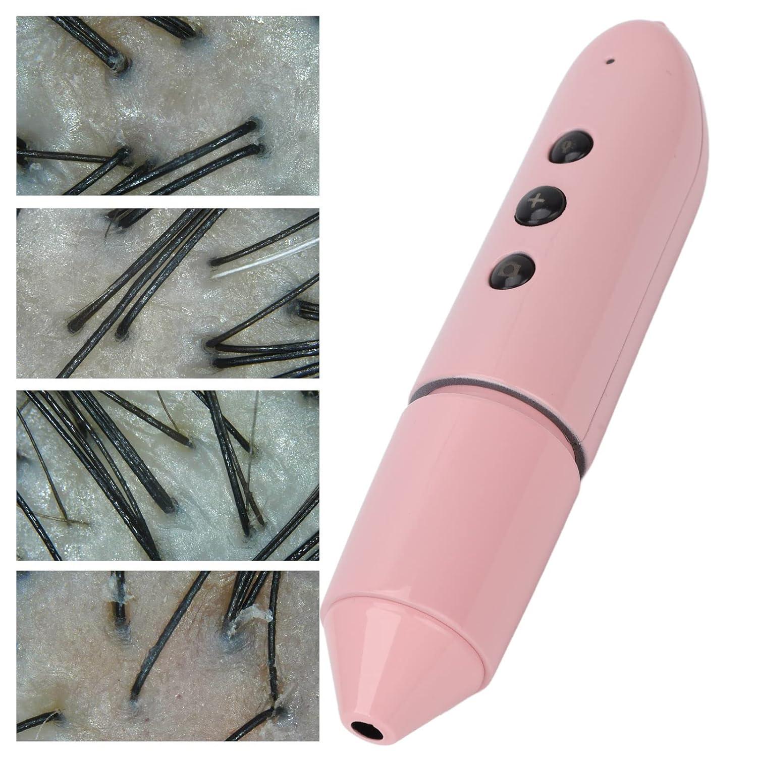 100X Magnification Skin Hair Scalp Detector | 2MP Camera Skin Health ...