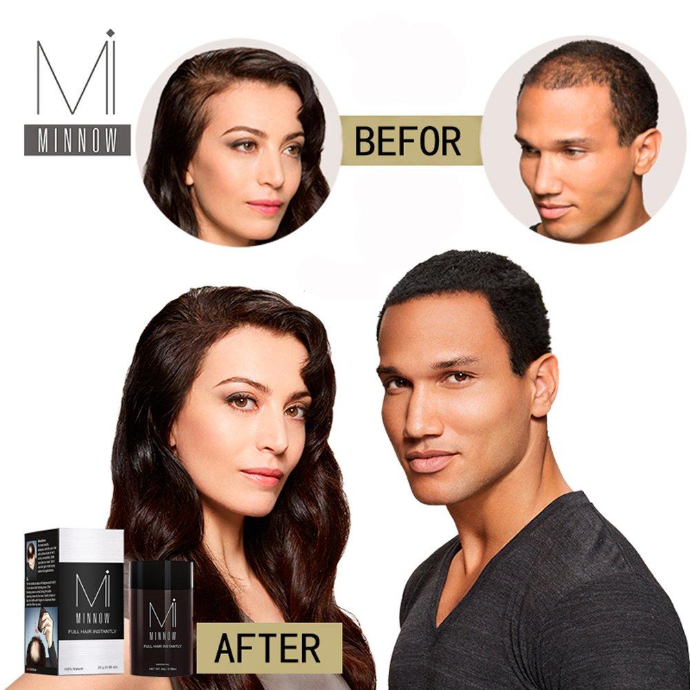 Natural Hair Loss Concealer - Hair Building Fibers for Men and Women 0 ...