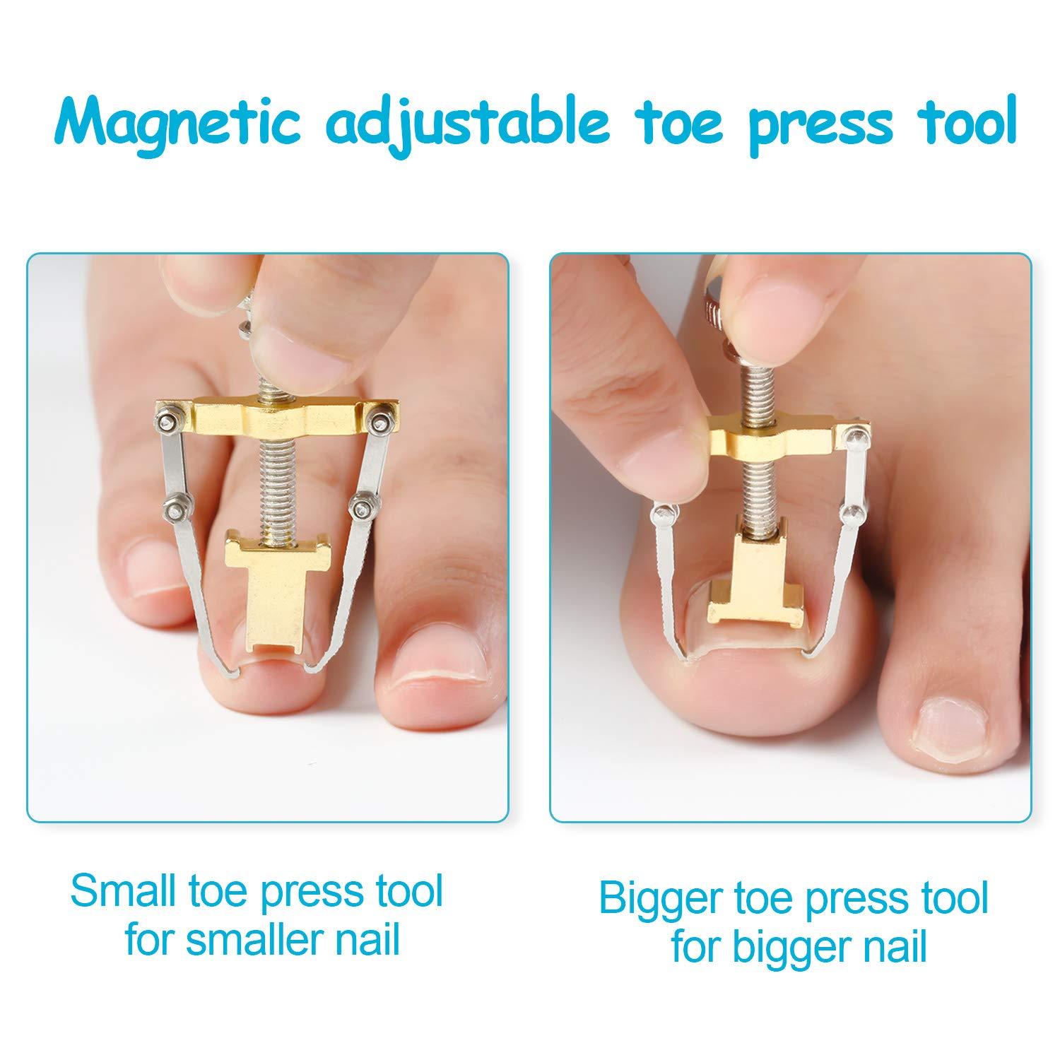 Ingrown Toenail Lifter Set - Stainless Steel Toe Clamp for Paronychia ...