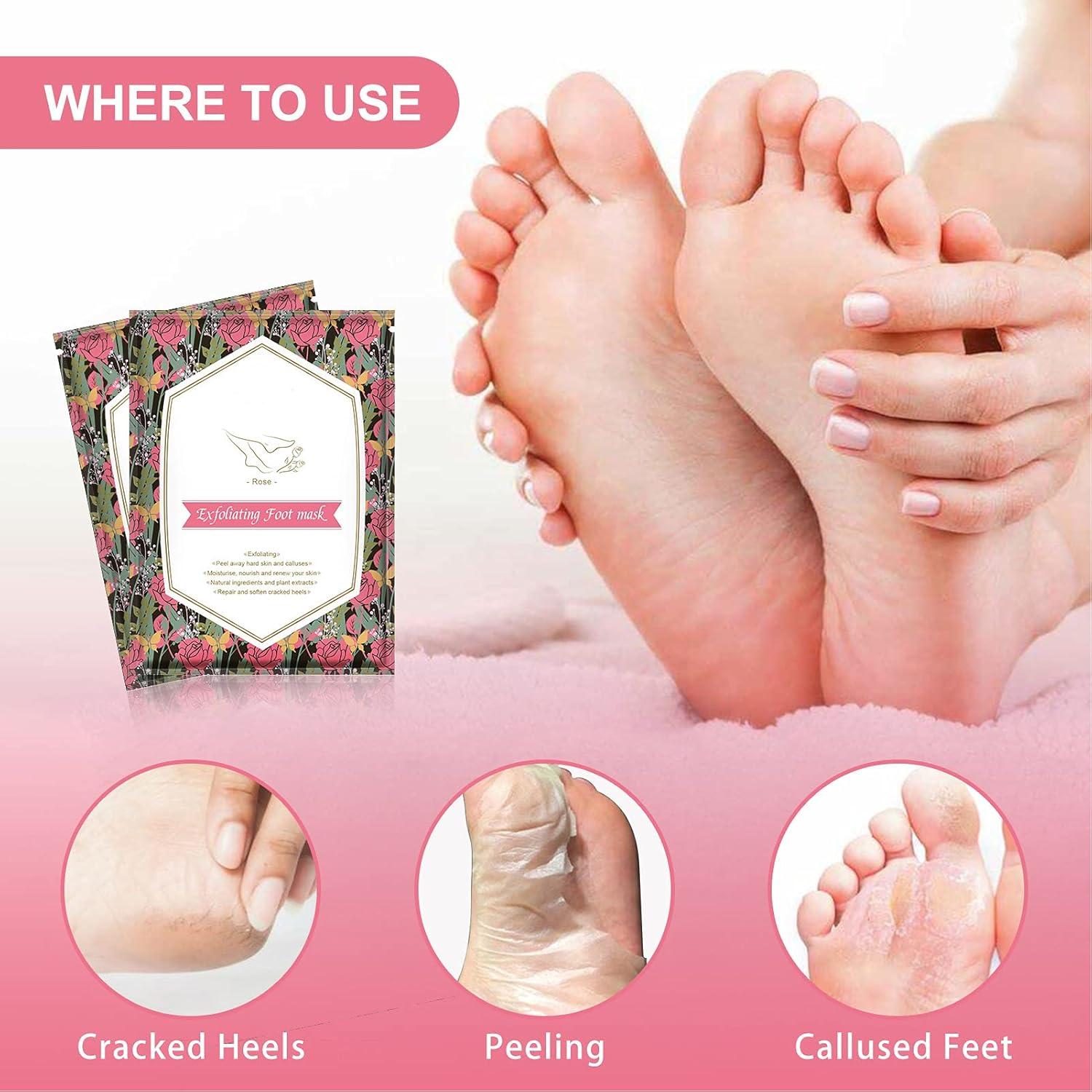 Rose Foot Peeling Mask - Quick Absorption for Cracked Heels & Softening ...