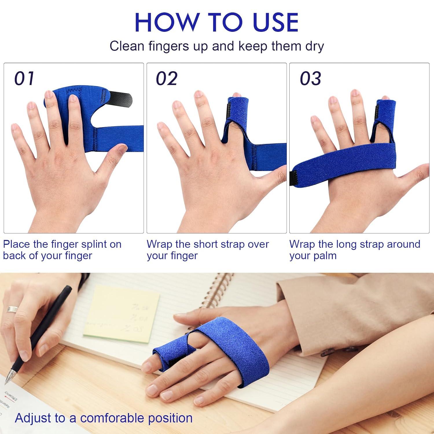 does splint help trigger finger