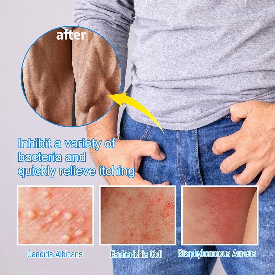 Balanitis Relief Ointment - Soothes Skin Irritation, Itch, Redness ...