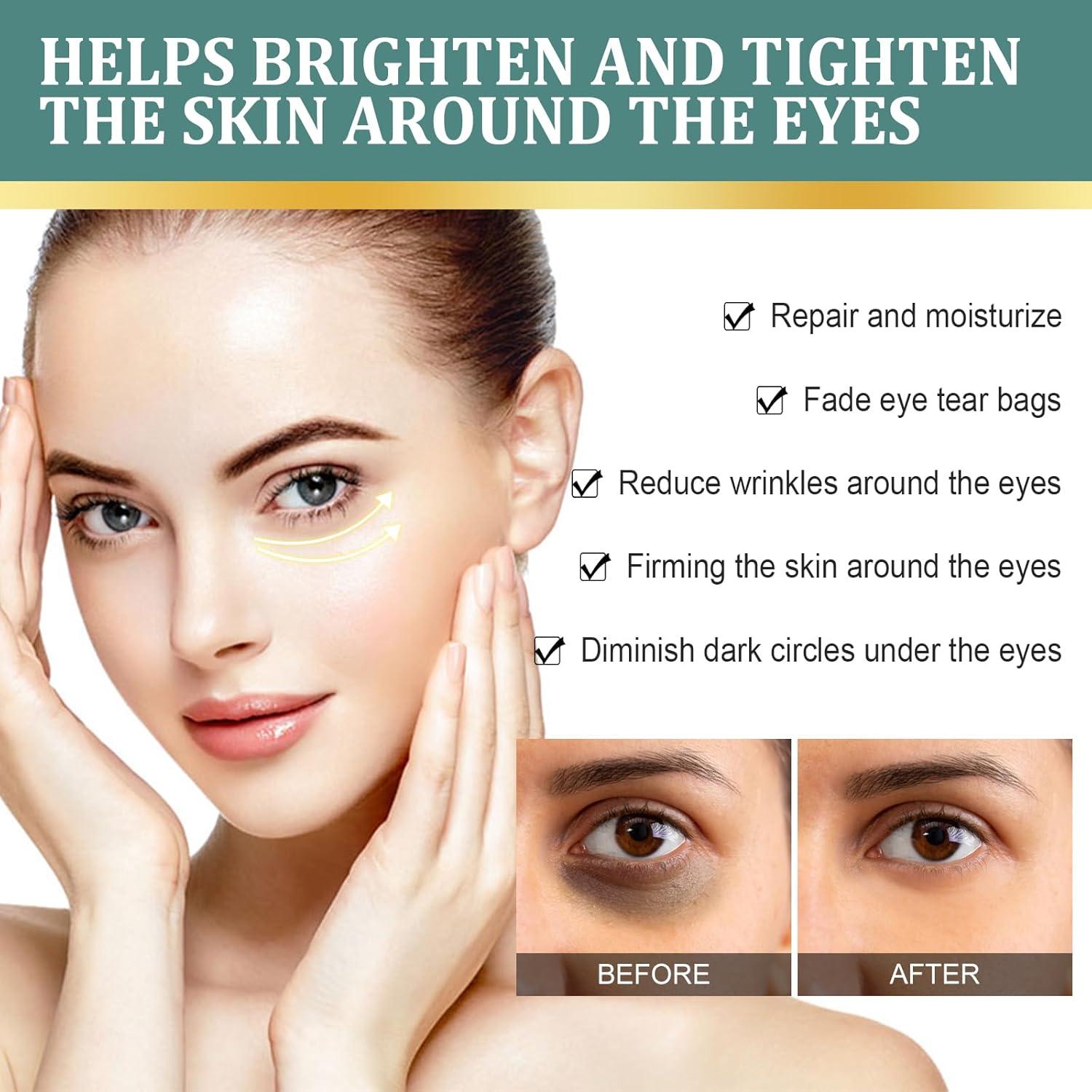 Jasmine Ointment for Dark Circles Active Jasmine Ointment Jasmine ...