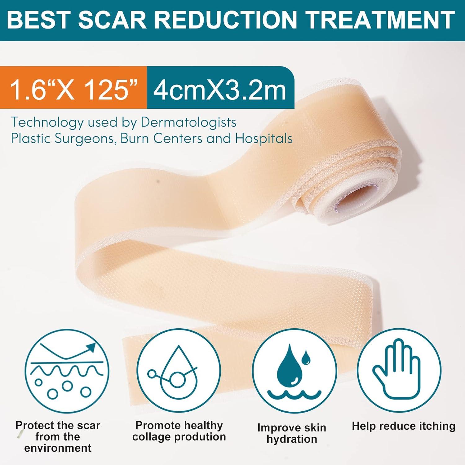 Silicone Scar Patch Roll (3Mx4cm) - Reusable Scar Treatment for Keloids ...